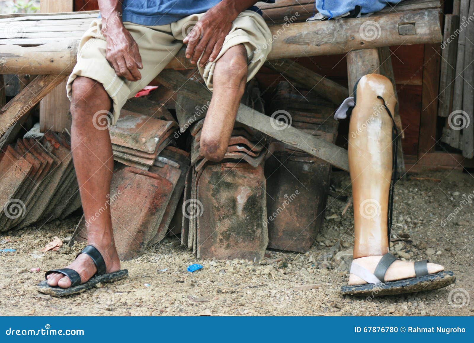 Poor disabled people editorial image. Image of business - 67876780