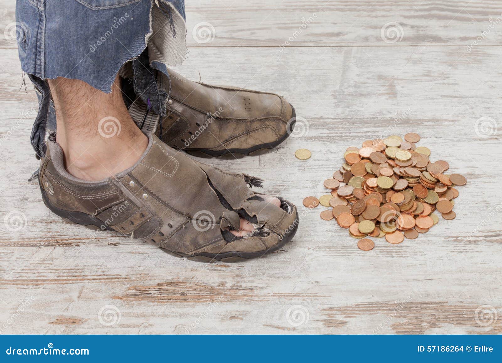 Poor feet stock photo. Image of business, broken, shoes - 57186264