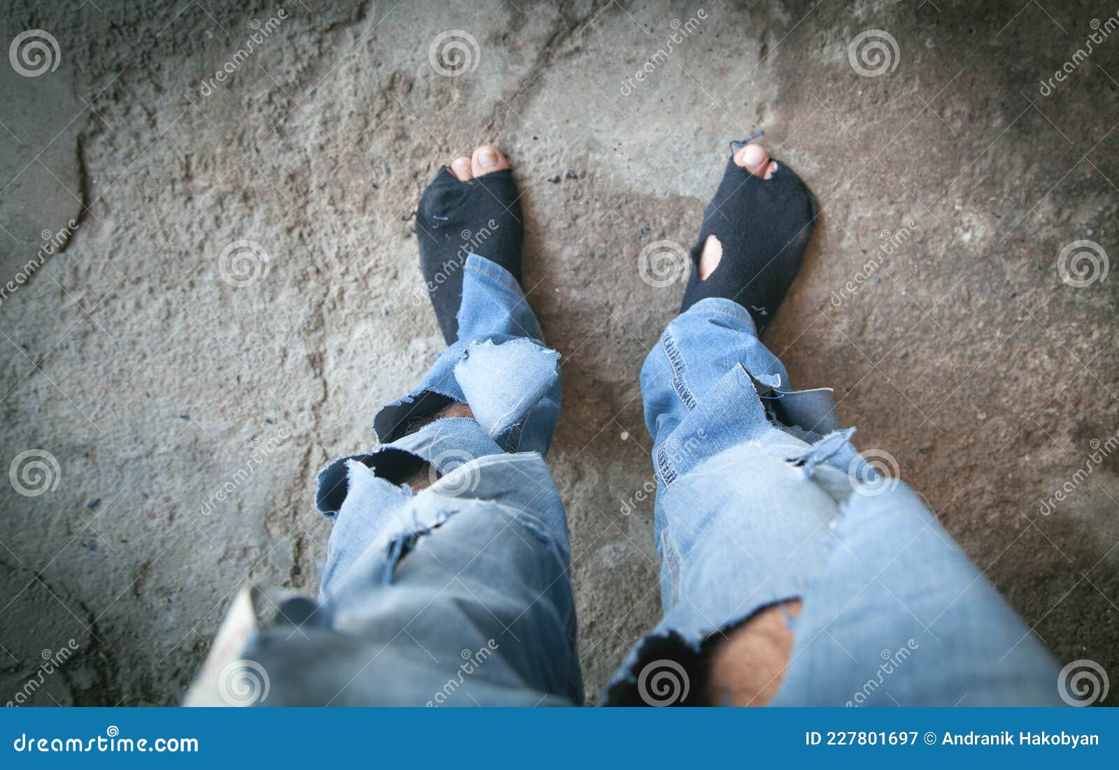 Poor Feets of a Caucasian Homeless Man Stock Image - Image of caucasian ...