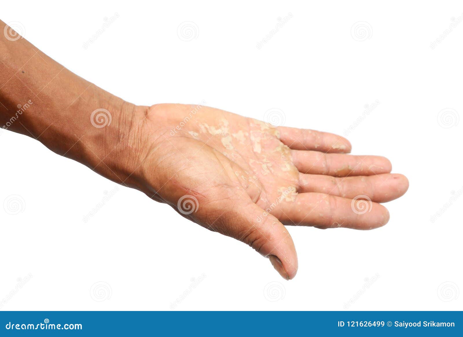Poor hands with hard. stock image. Image of cracked - 121626499