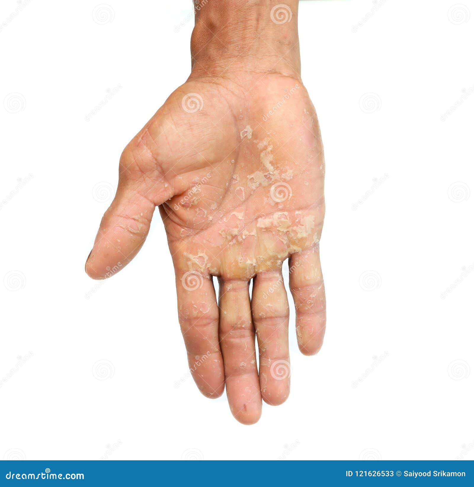 Poor hands with hard. stock image. Image of dirty, hardened - 121626533