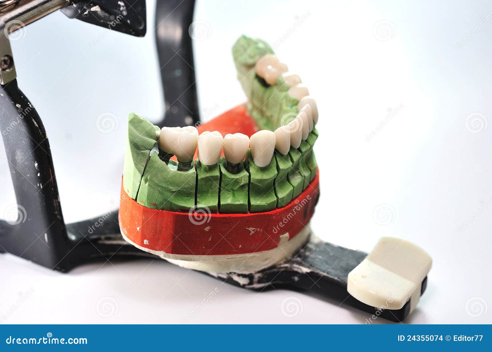Porcelain Teeth on Prosthesis Ceramic Model Stock Photo - Image of ...
