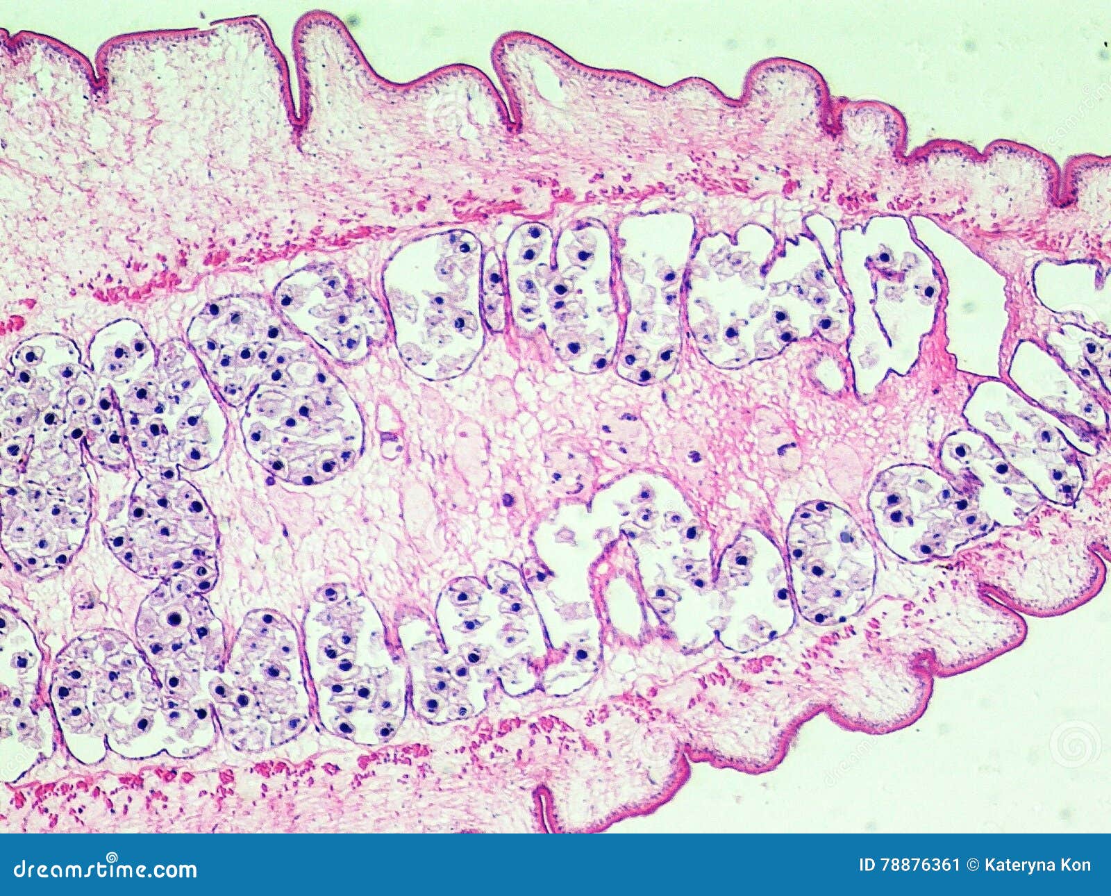 Pork Tapeworm Taenia Solium Stock Image | CartoonDealer.com #78876367