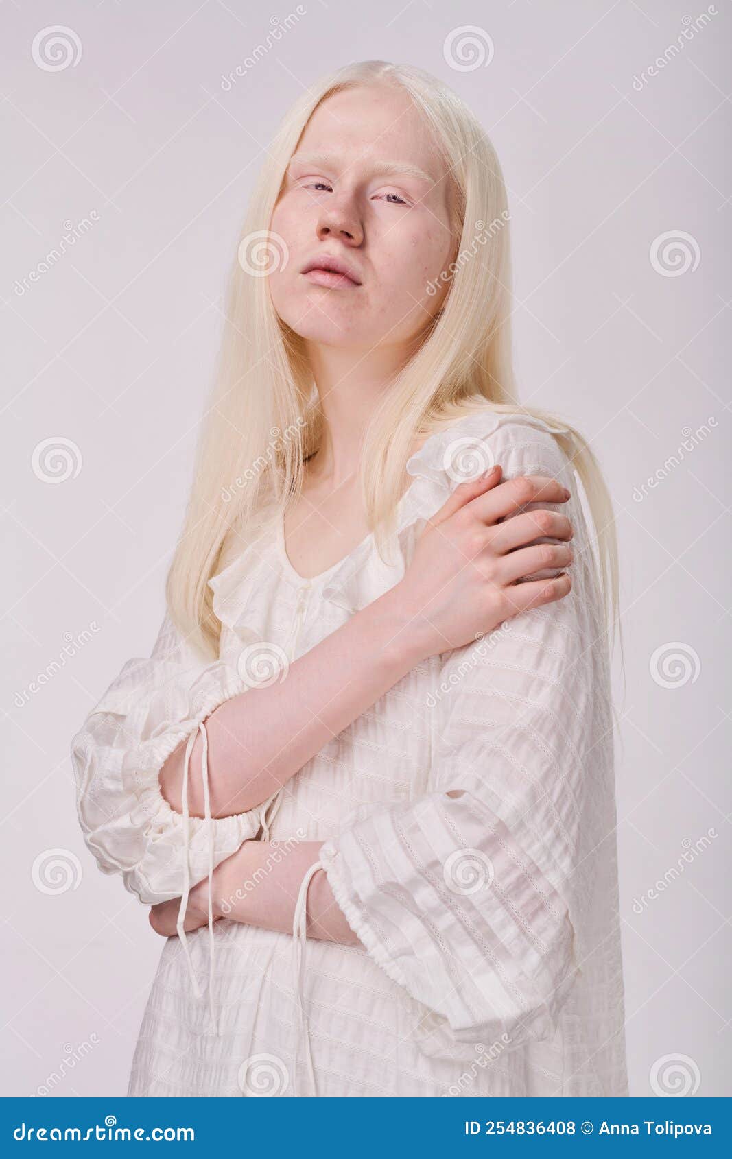 Albino Model Posing at Camera Stock Photo - Image of caucasian ...