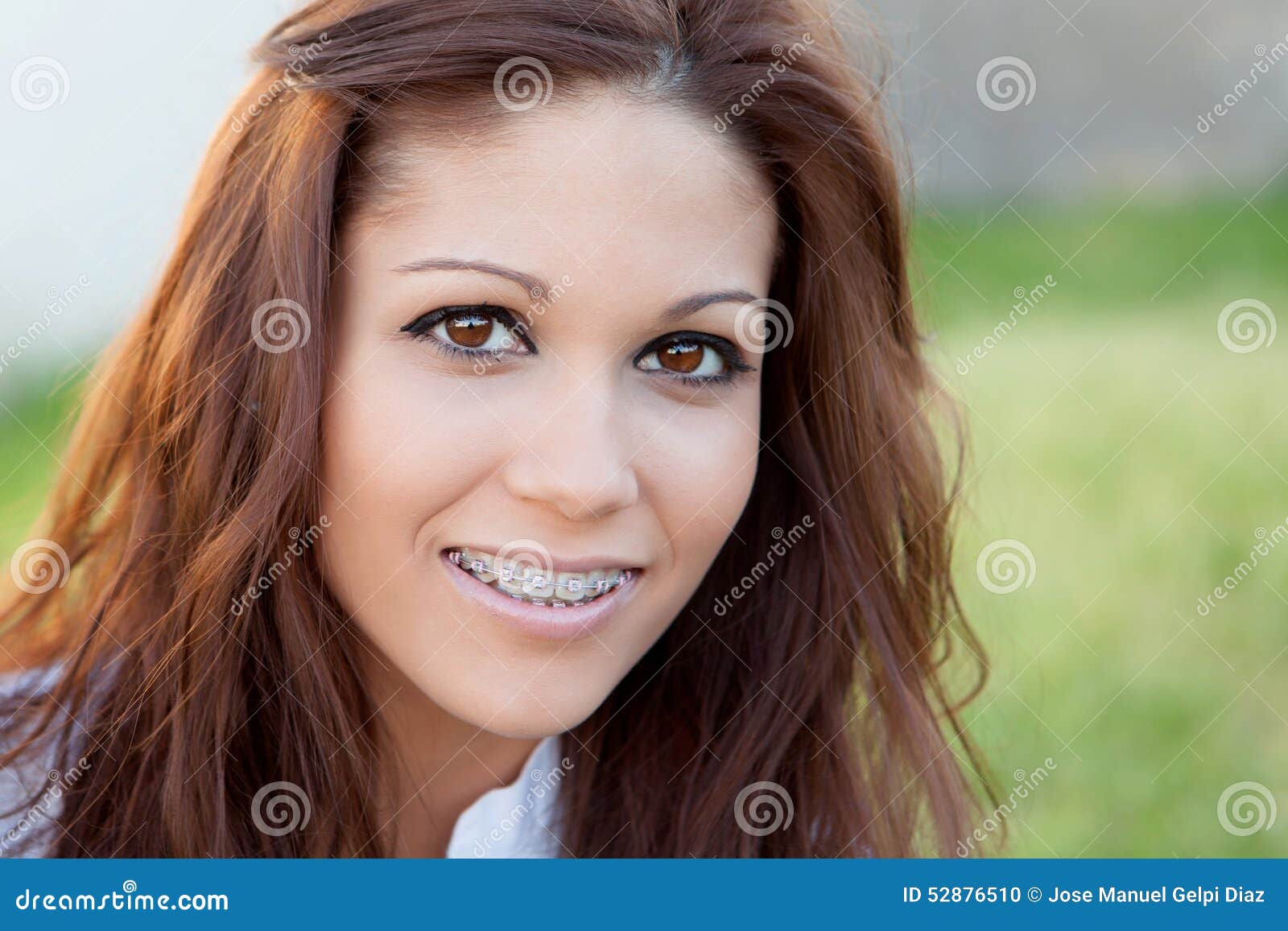 Portrait of a Beautiful Girl with Brackets Stock Photo - Image of ...
