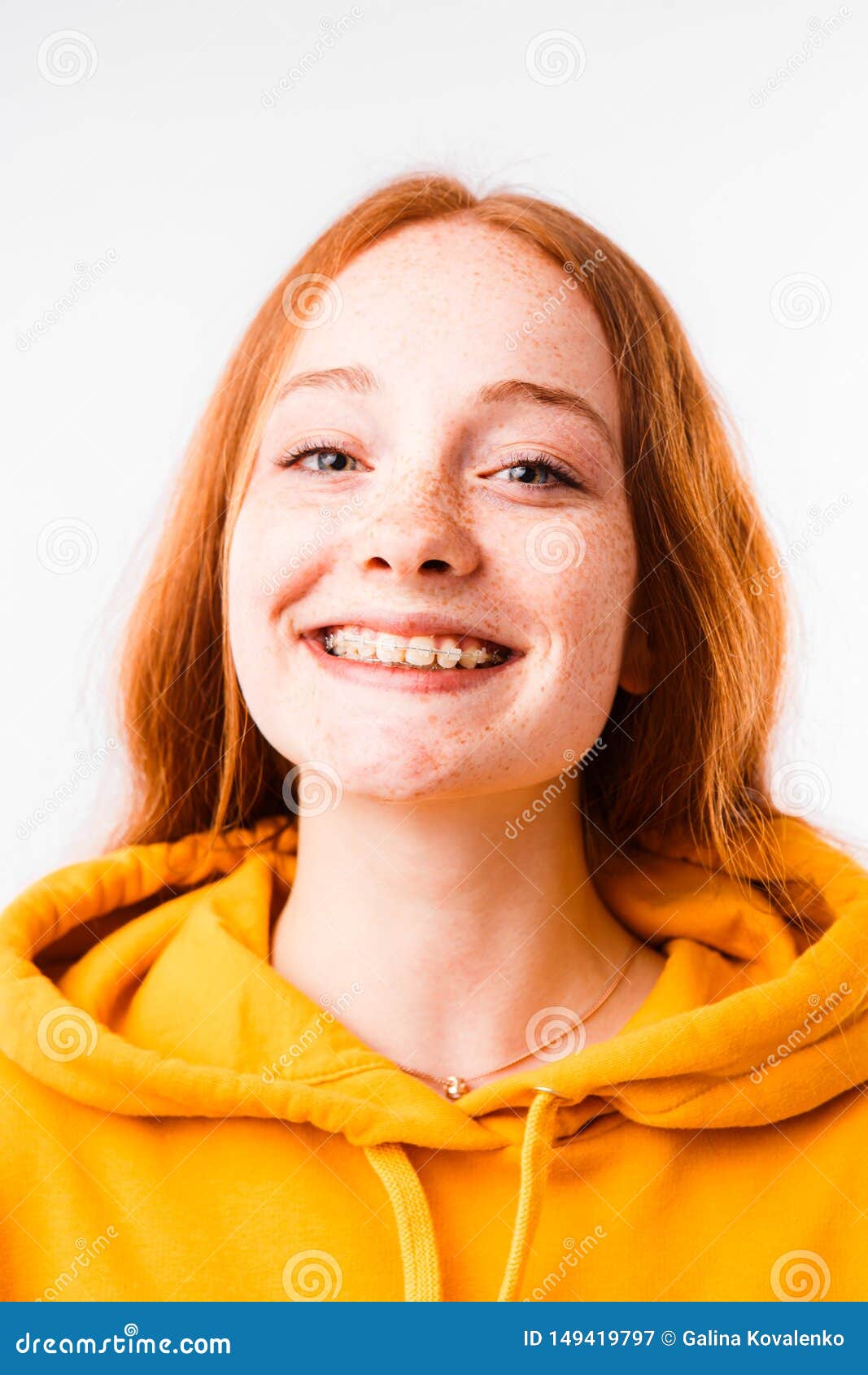 Portrait Of An Emotional Red Haired Girl With Freckles And Braces On A