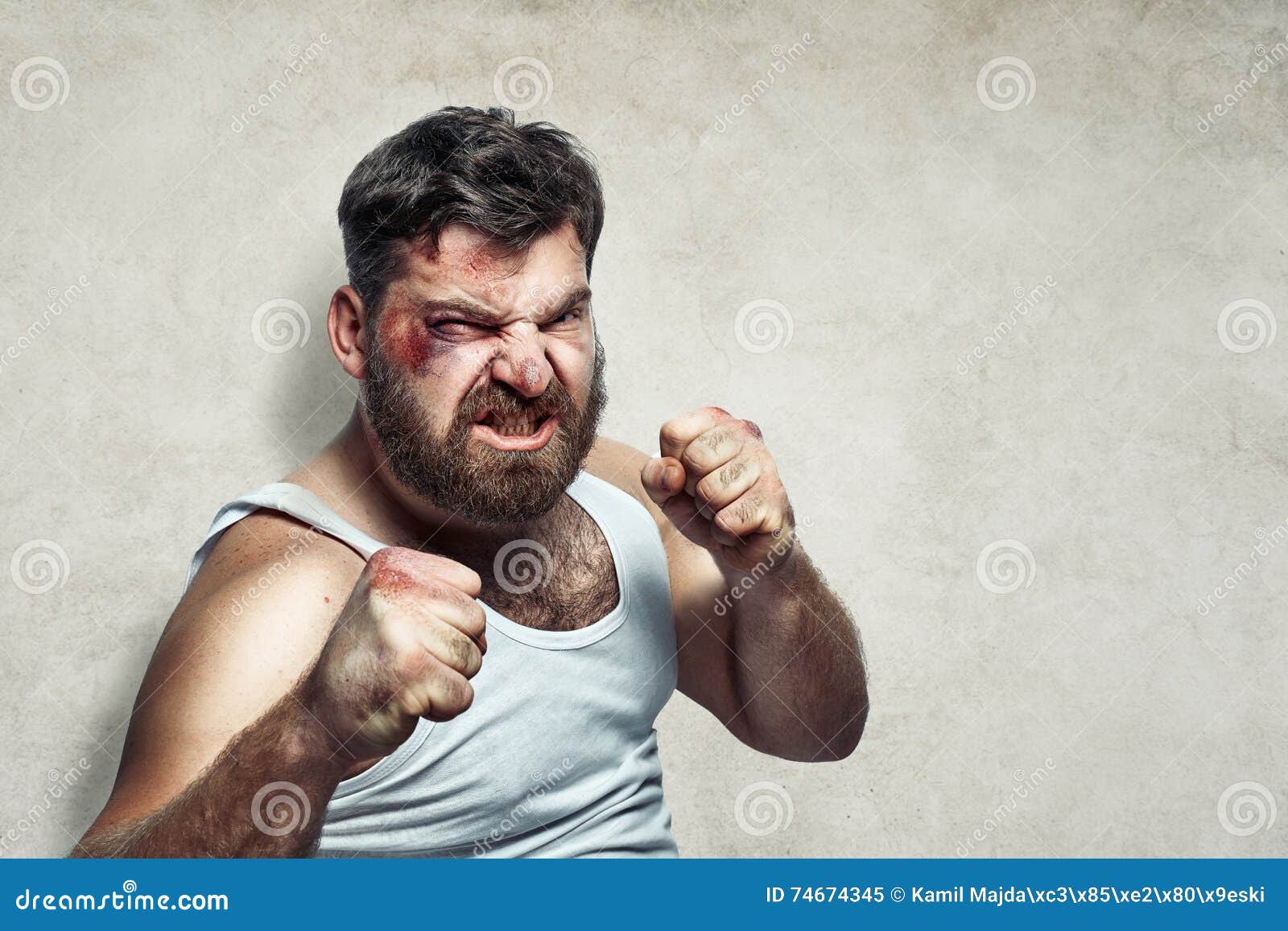 Portrait of a Funny Injured Fighter Stock Image - Image of people ...