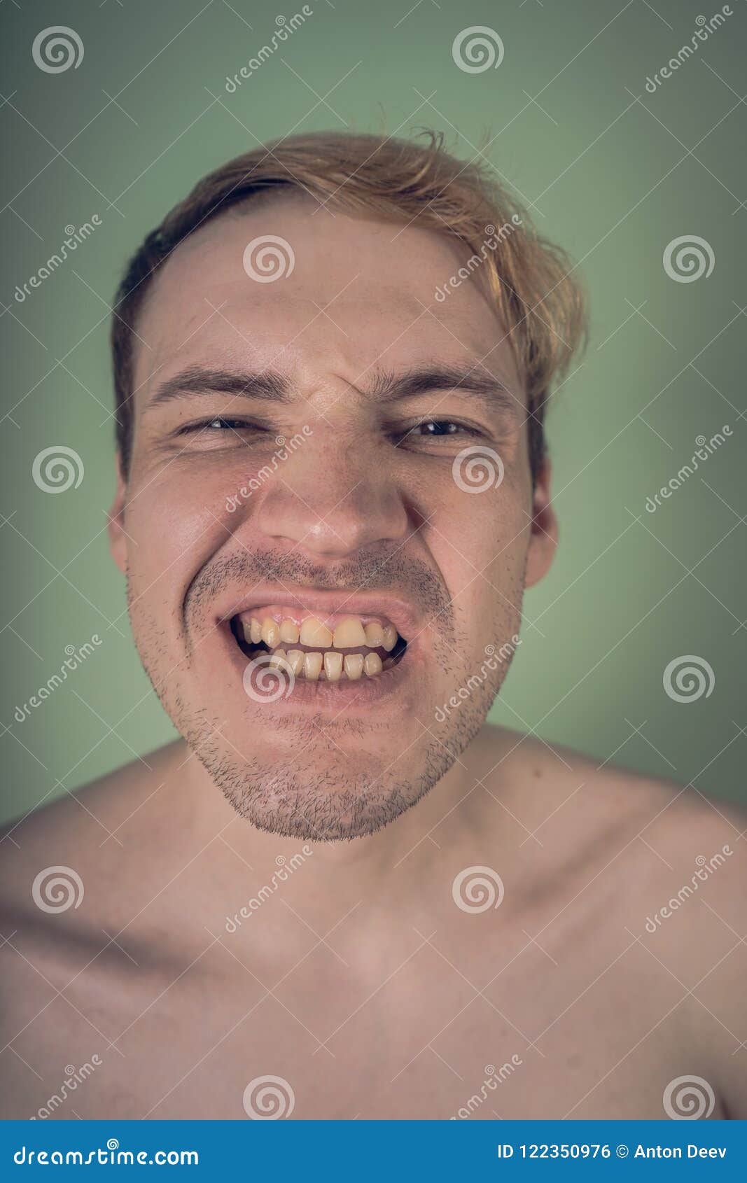 Guy shows his teeth stock photo. Image of anxiety, concept - 122350976