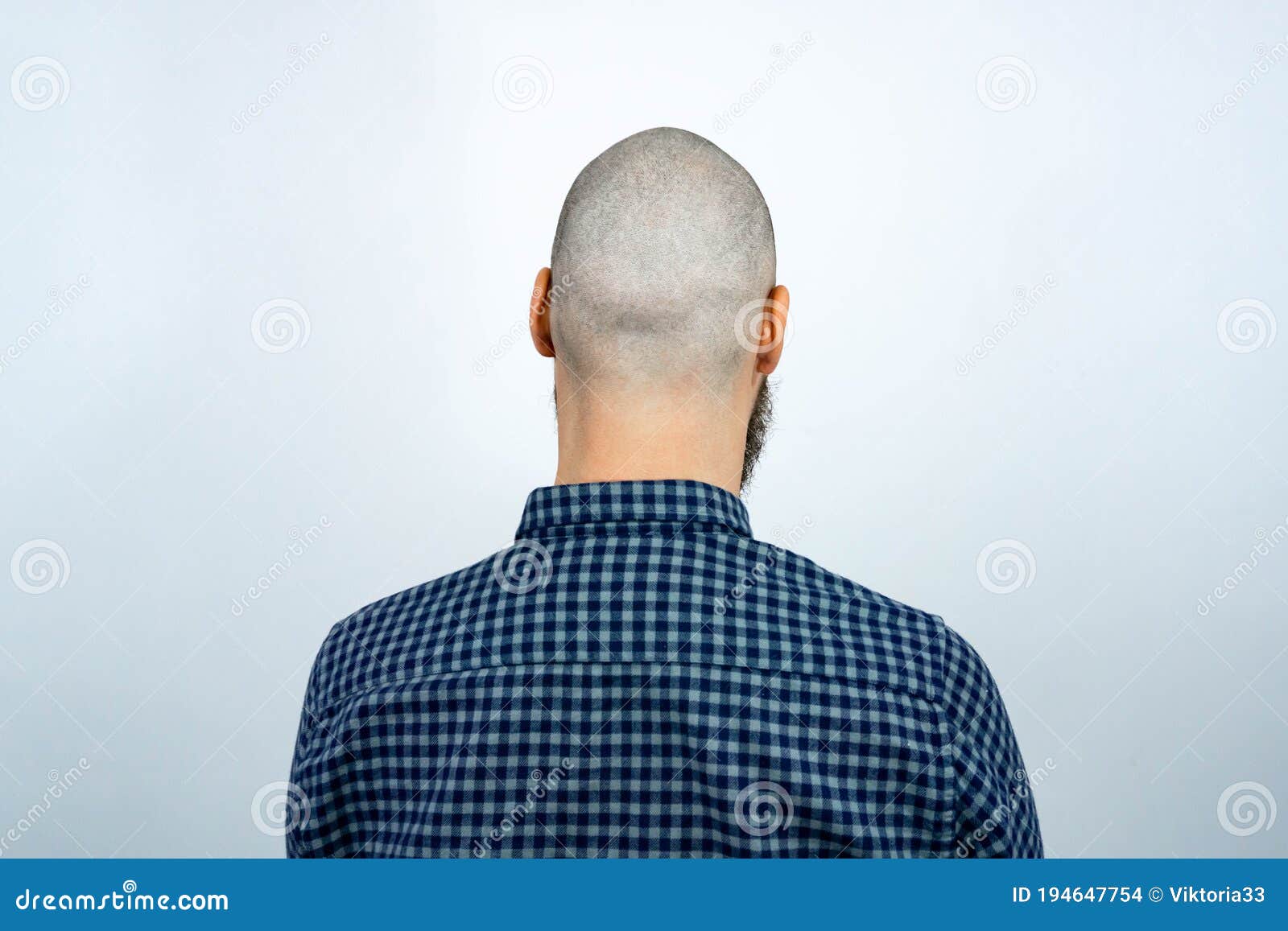 Portrait of Head Bald Man with Alopecia, Back View Stock Photo - Image ...