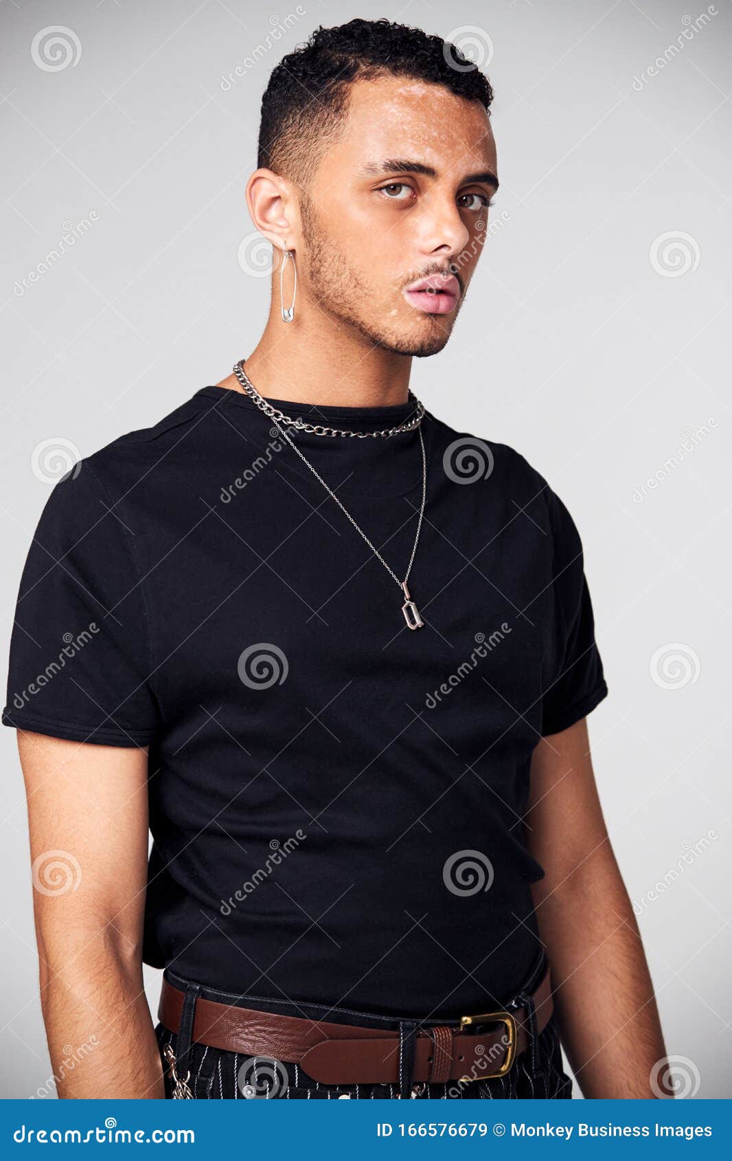 Portrait of Thoughtful Young Man with Skin Pigmentation Disorder ... Portrait of Thoughtful Young Man with Skin Pigmentation Disorder ...