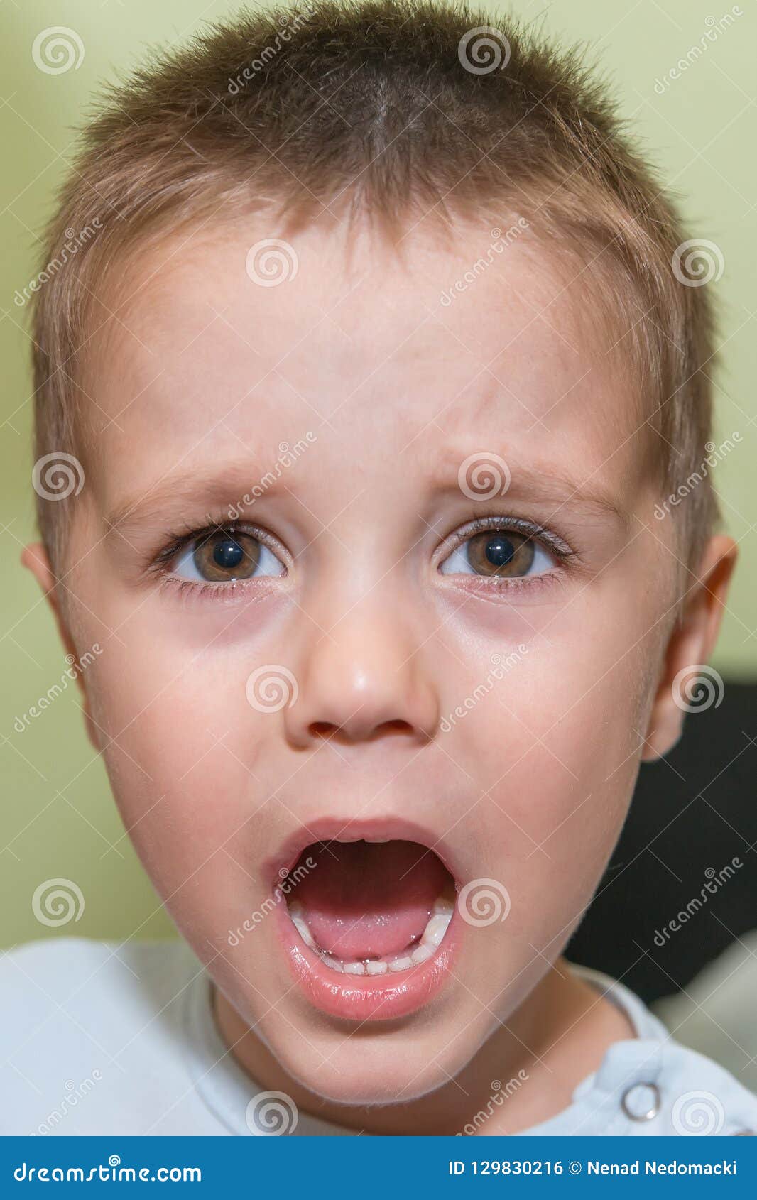 Portrait of Upset and Angry Boy Stock Photo - Image of cast, gypsum ...