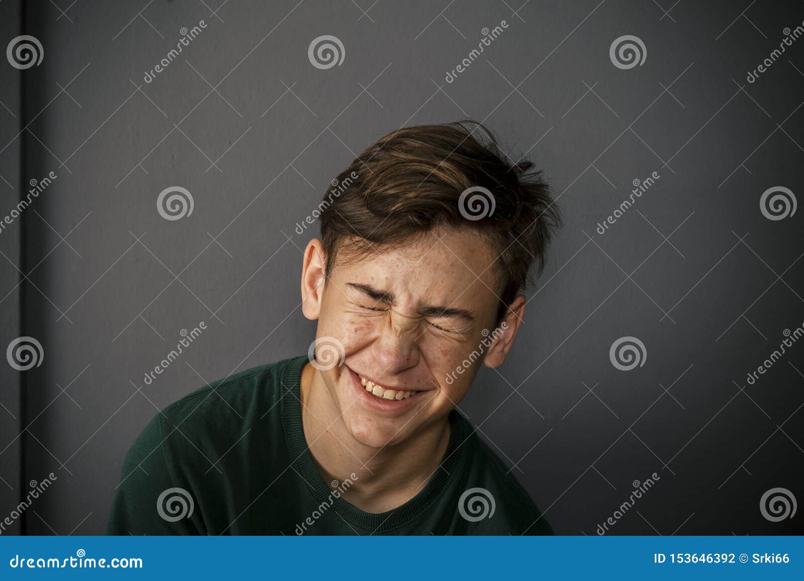 Portrait of Young Boy with Acne Problems Stock Photo - Image of ...