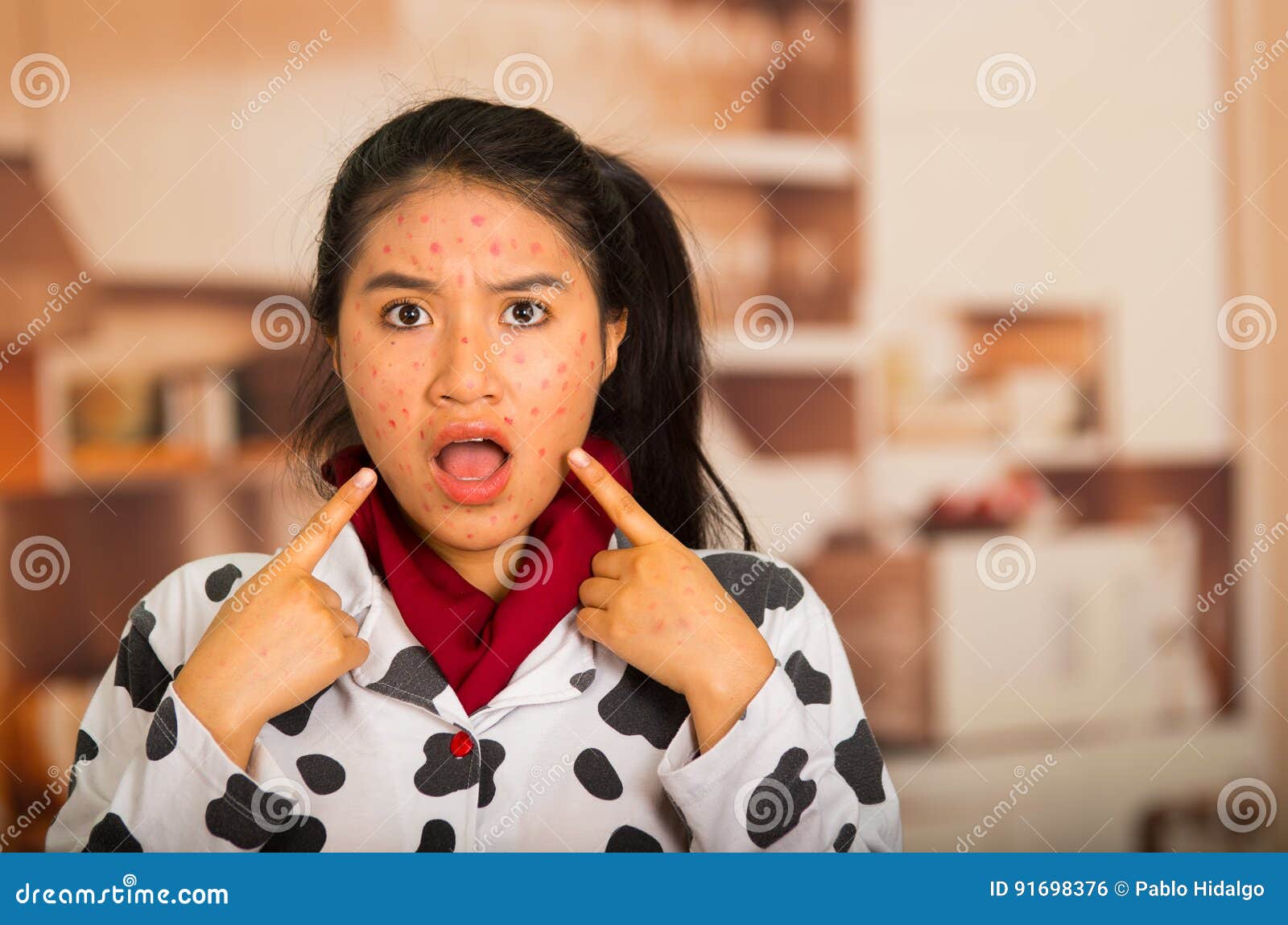Portrait of Young Girl with Skin Problem Got Surprised Stock Photo ...