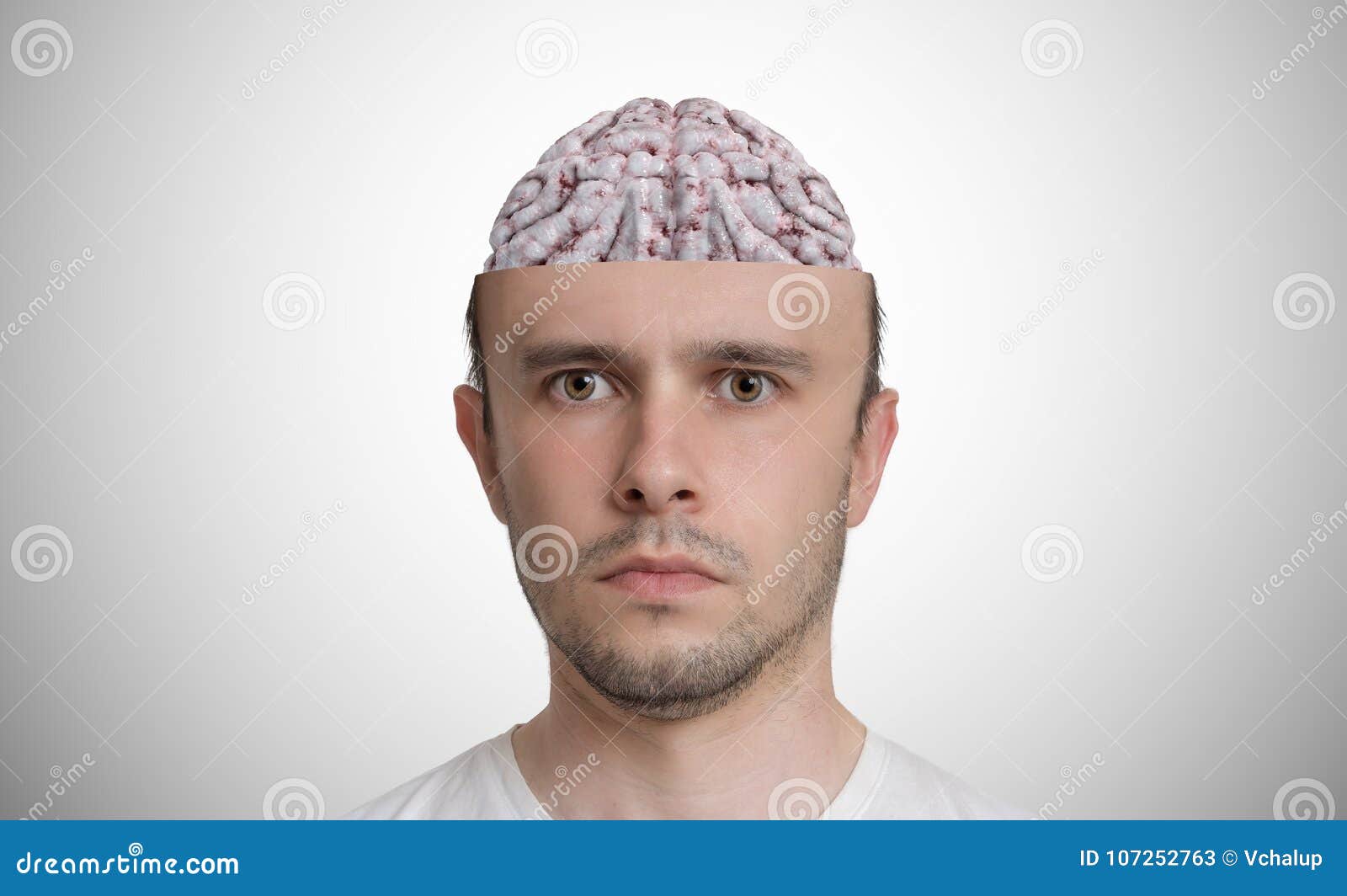 Portrait of Young Man with Opened Head with Brain Inside Stock Image ...