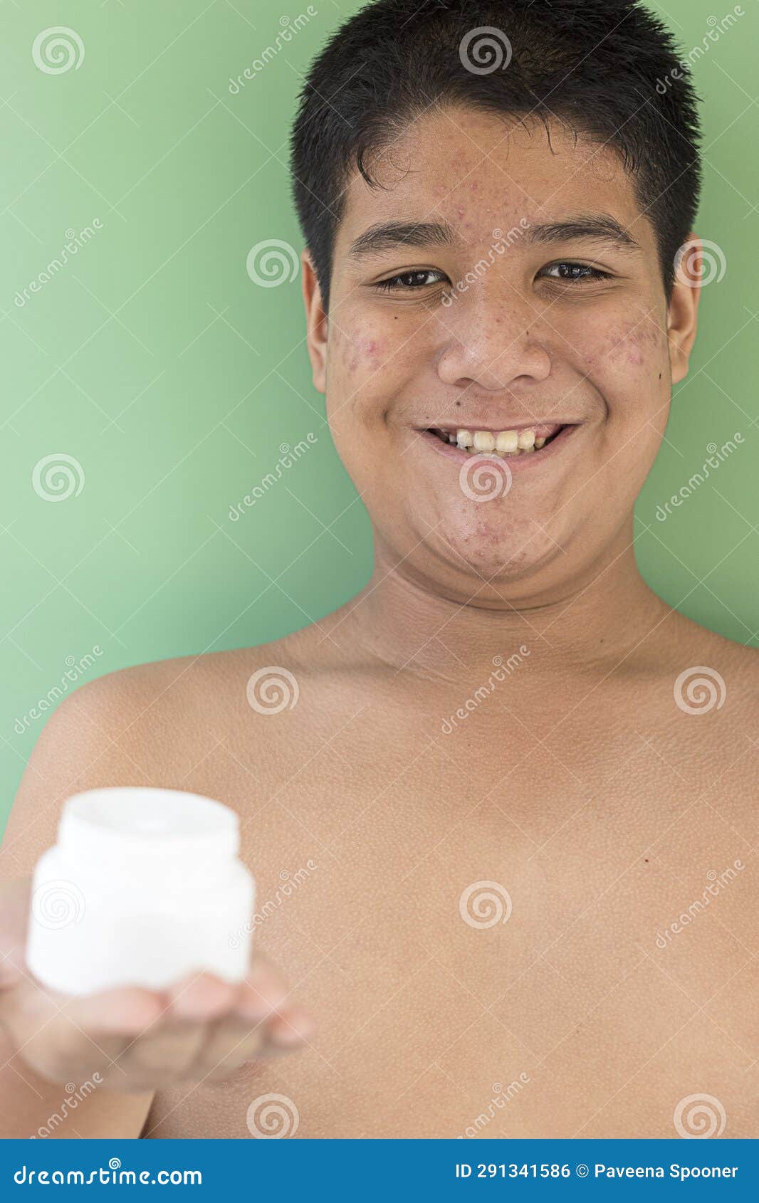 Portrait of Young Man with White Cream. Problematic Skin and ...