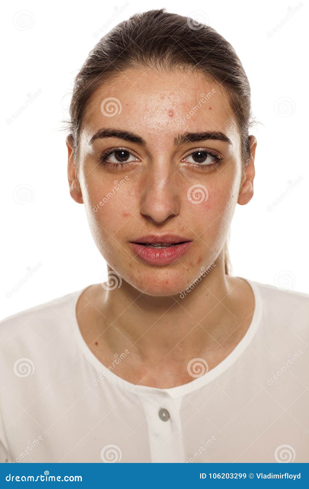 Problematic skin stock image. Image of infection, irritation - 106203299