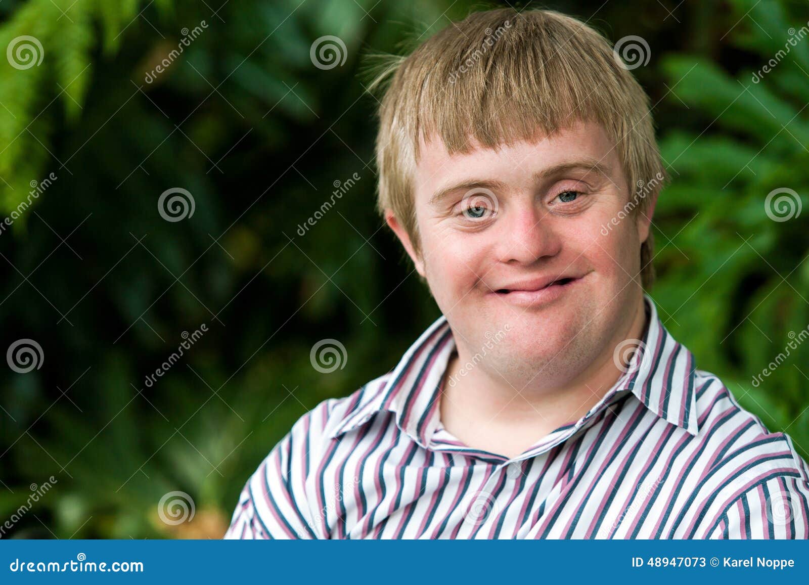 Portret Van De Jonge Gehandicapte Mens Stock Afbeelding - Image of ...