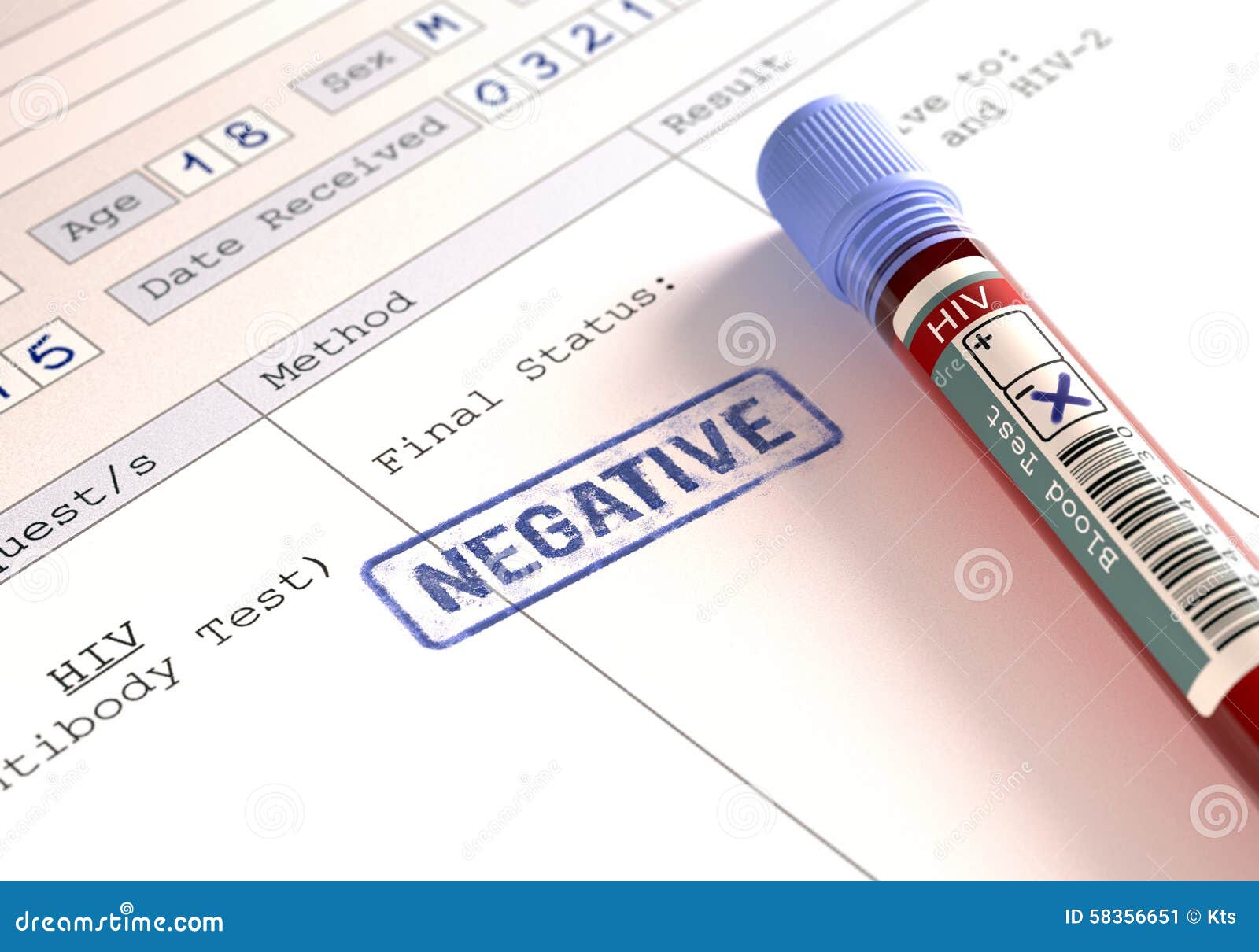 Positief en negatief HIV stock afbeelding. Image of geneesmiddel - 58356651