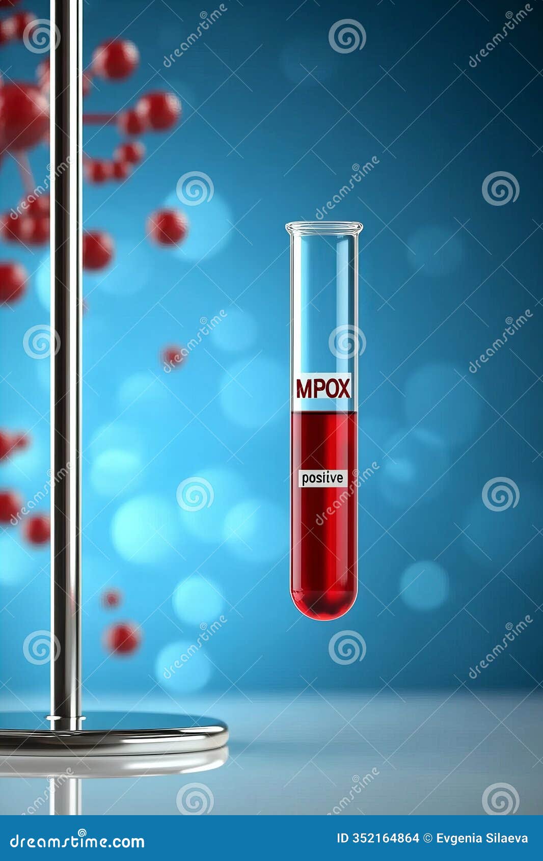 Positive Mpox Blood Test In A Laboratory Setting With Virus Model Stock ...