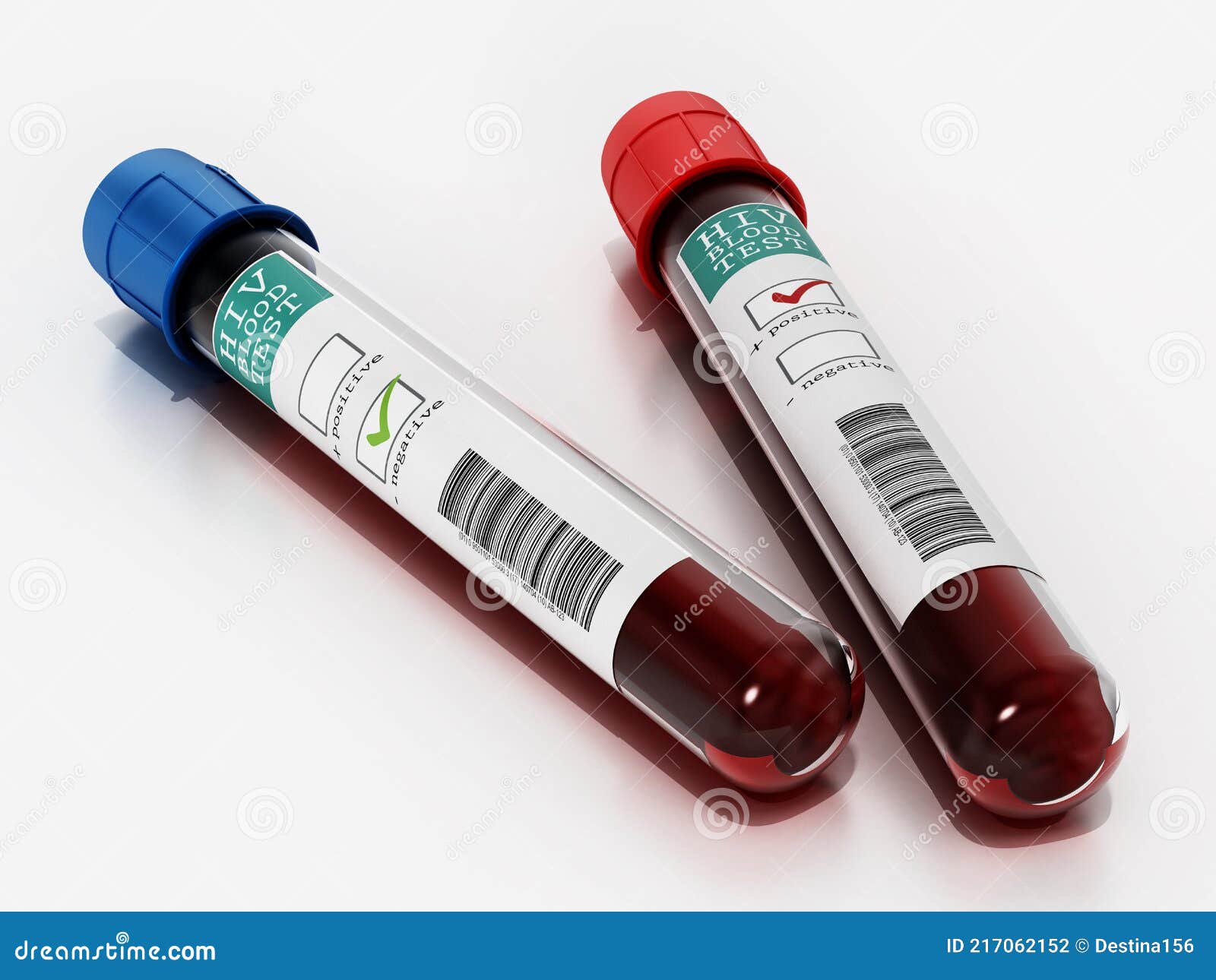 Positive and Negative Blood Samples in Vials with HIV Test Labels. 3D ...
