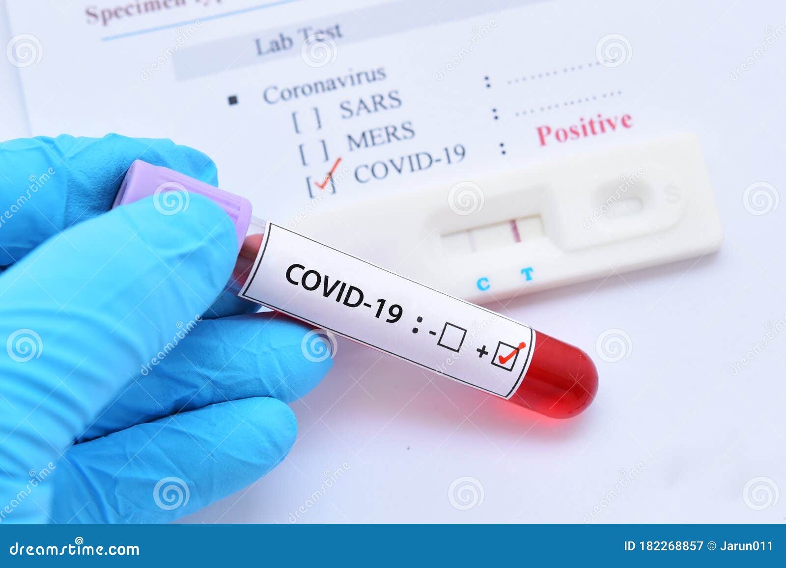 Positive Test Result by Using Rapid Test Device for COVID-19 Virus ...