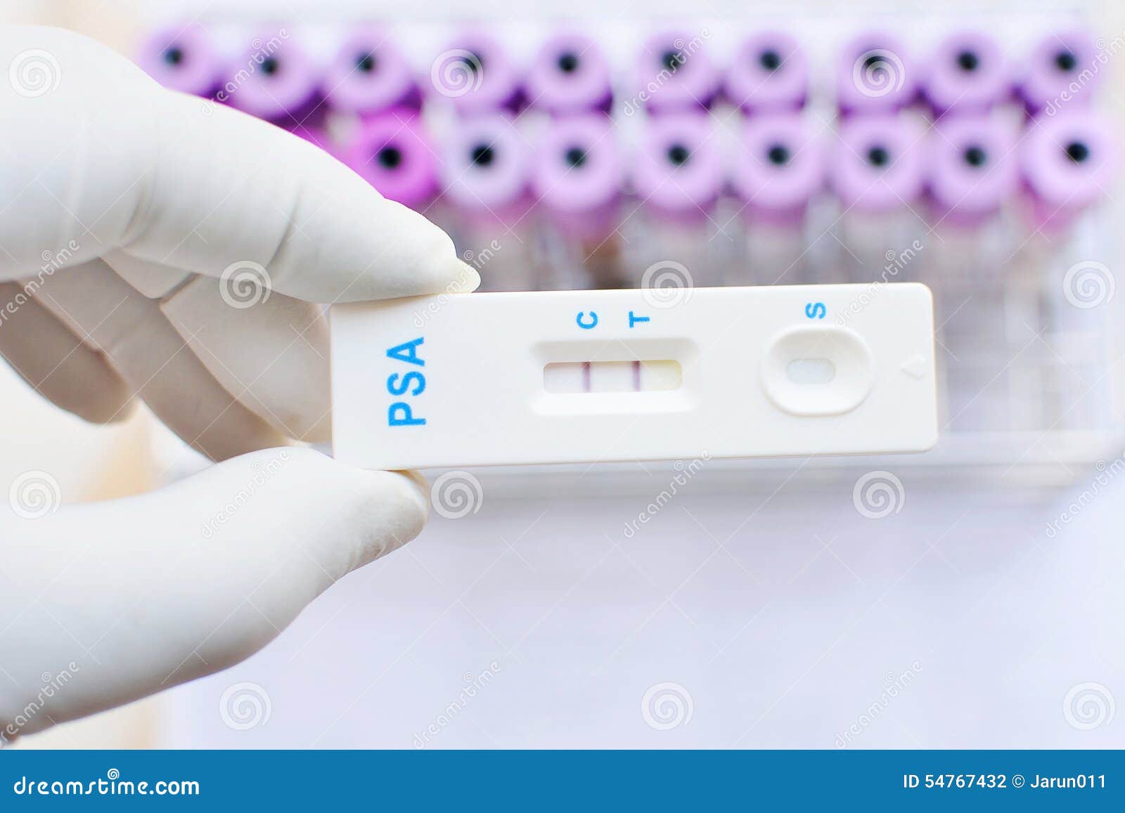 Positivo del PSA foto de archivo. Imagen de tumor, marcador - 54767432