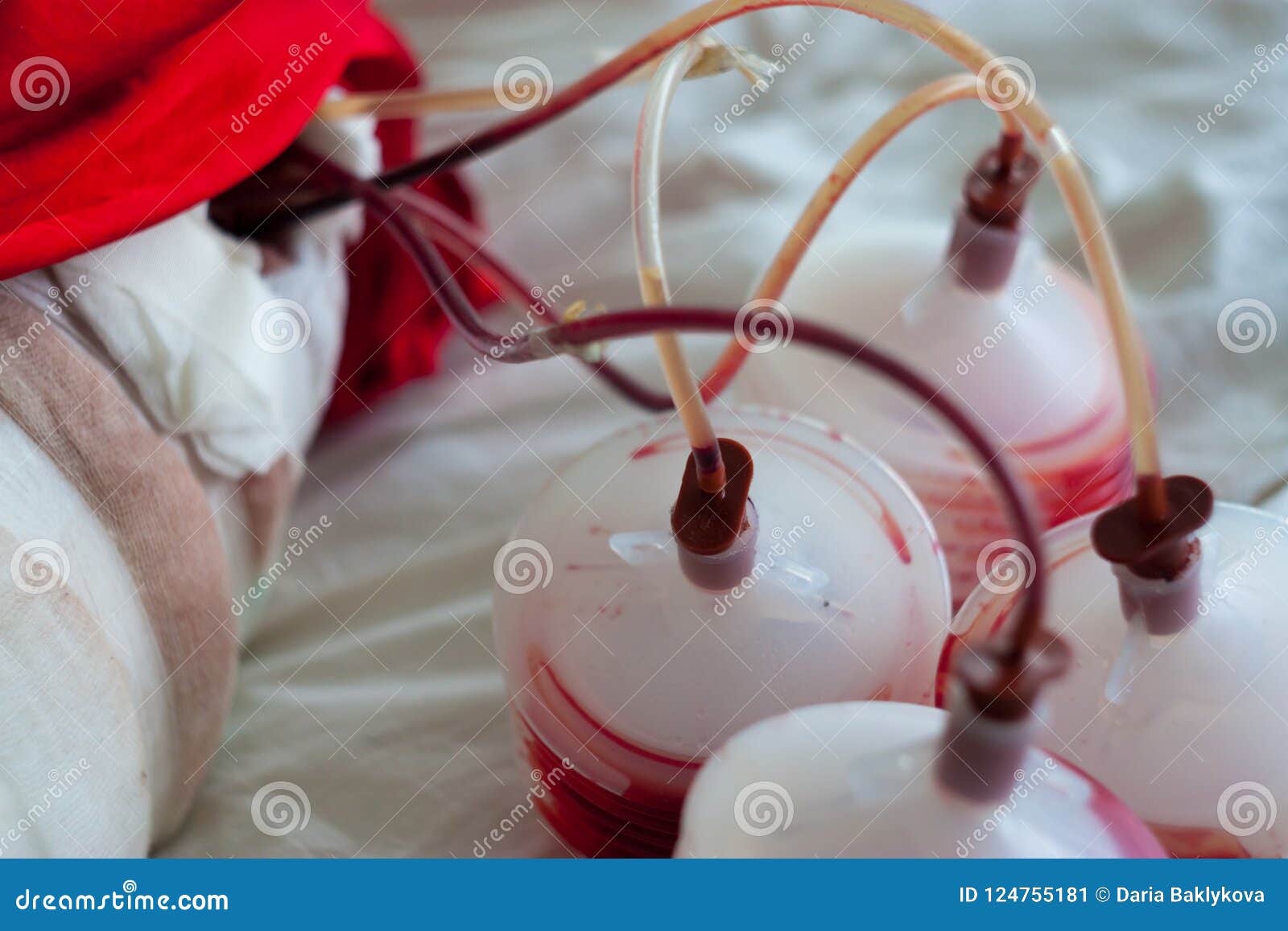 Postoperative drainage stock image. Image of medicine - 124755181