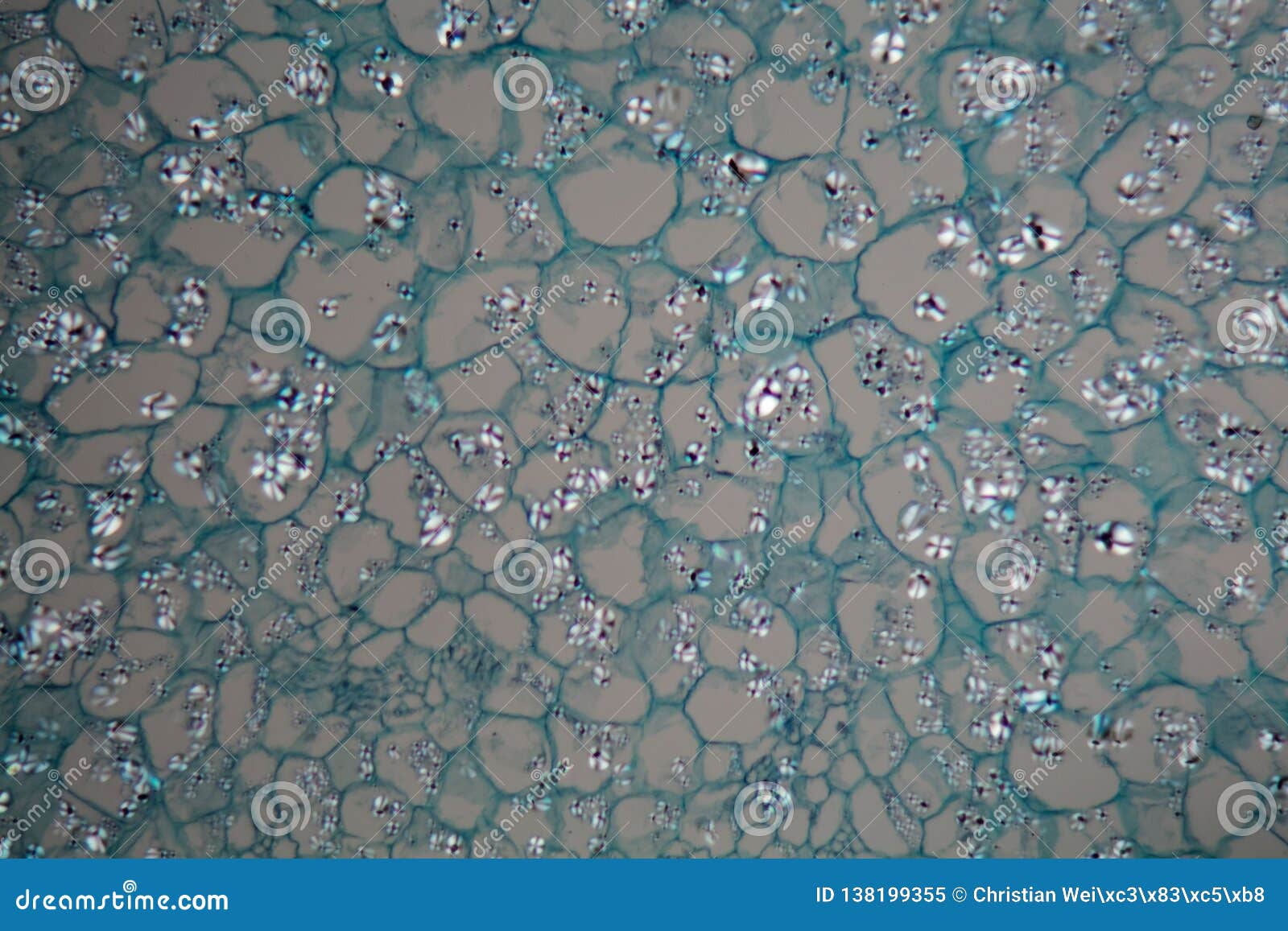 Potato Cells with Starch Corns Under the Microscope Stock Image - Image ...
