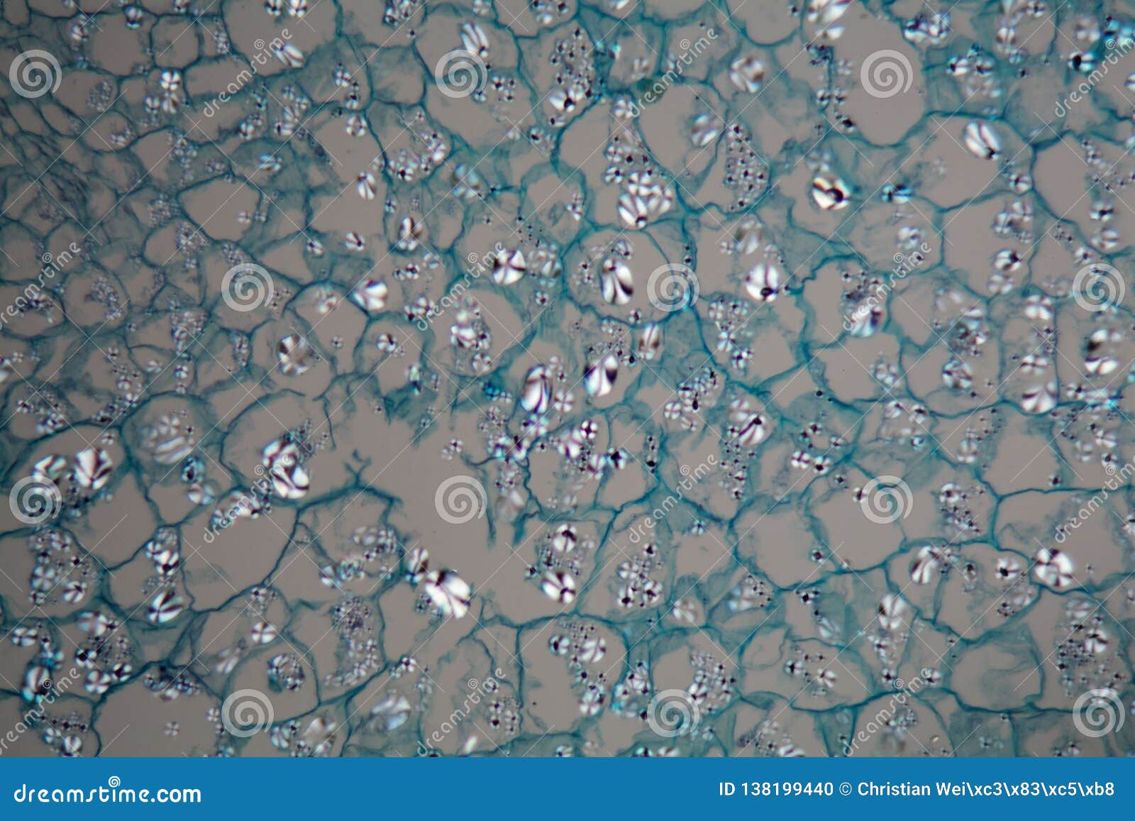Potato Cells with Starch Corns Under the Microscope Stock Photo - Image ...