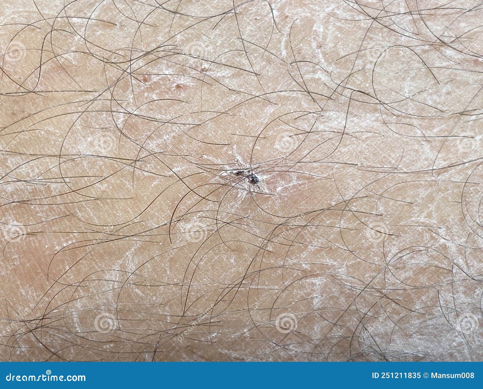 Powder on body skin stock image. Image of beautiful - 251211835