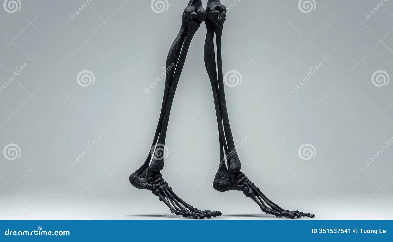 Emphasizing The Frailty Of Anorexia: Close-Up Of Extremely Thin Legs ...