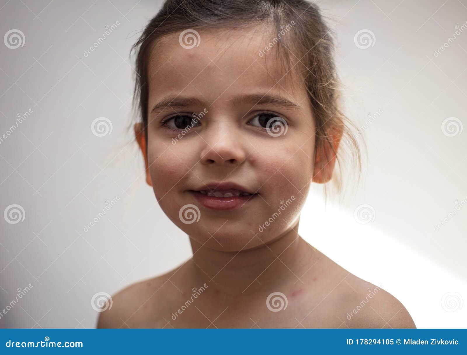 Pox are Not a Problem for Me Stock Image - Image of epidemic, house ...