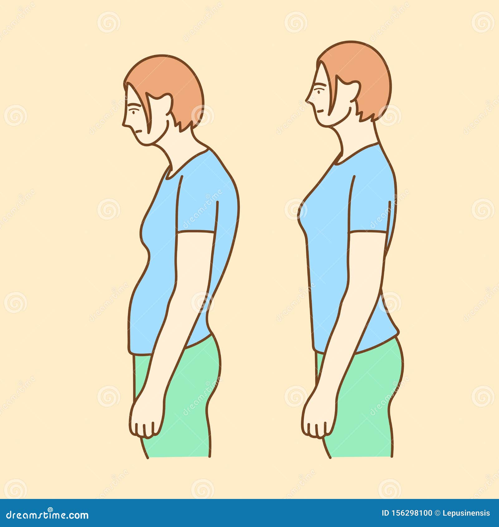 People with Impaired Posture Position Defect Scoliosis and Ideal ...