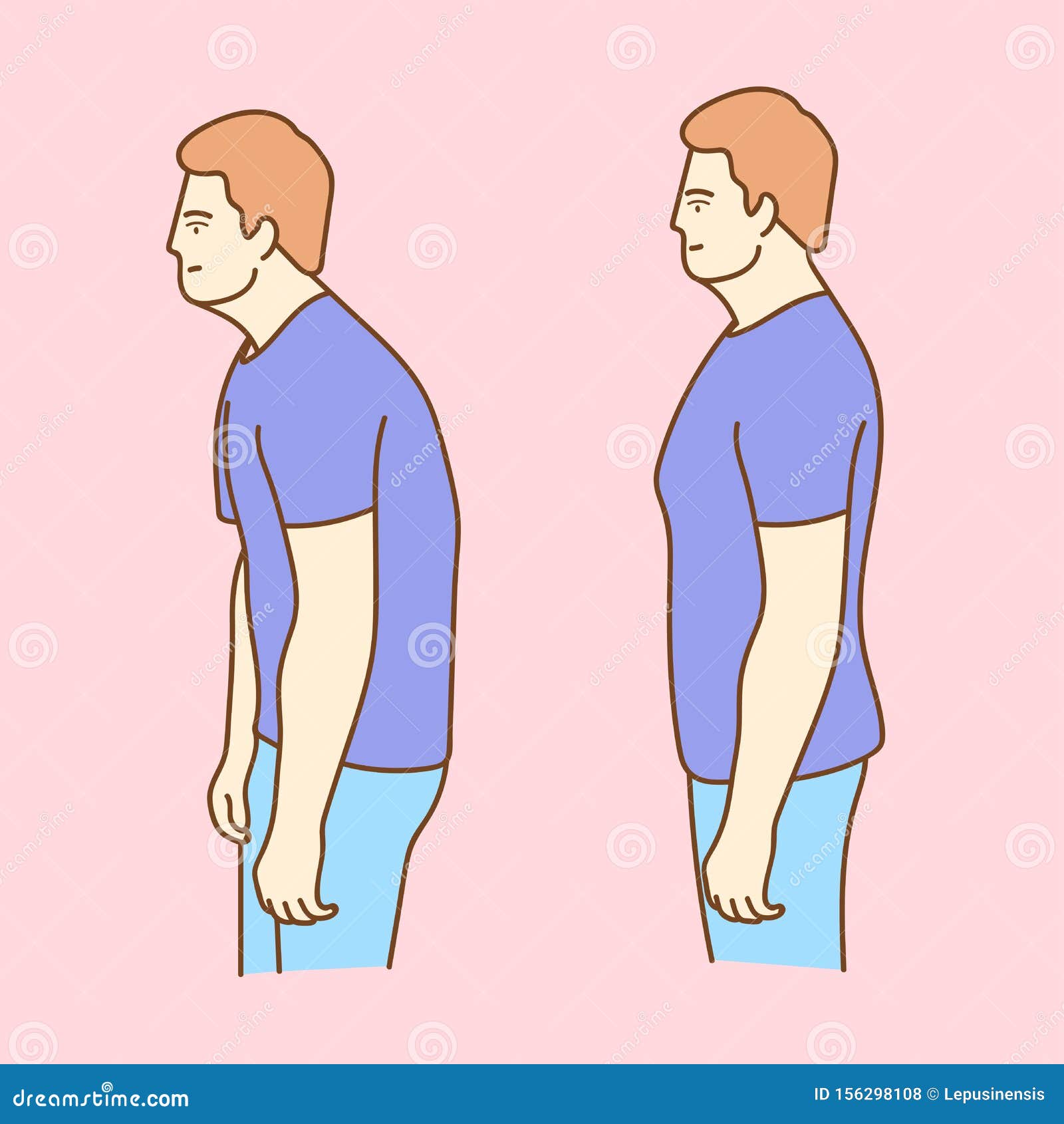 People with Impaired Posture Position Defect Scoliosis and Ideal ...