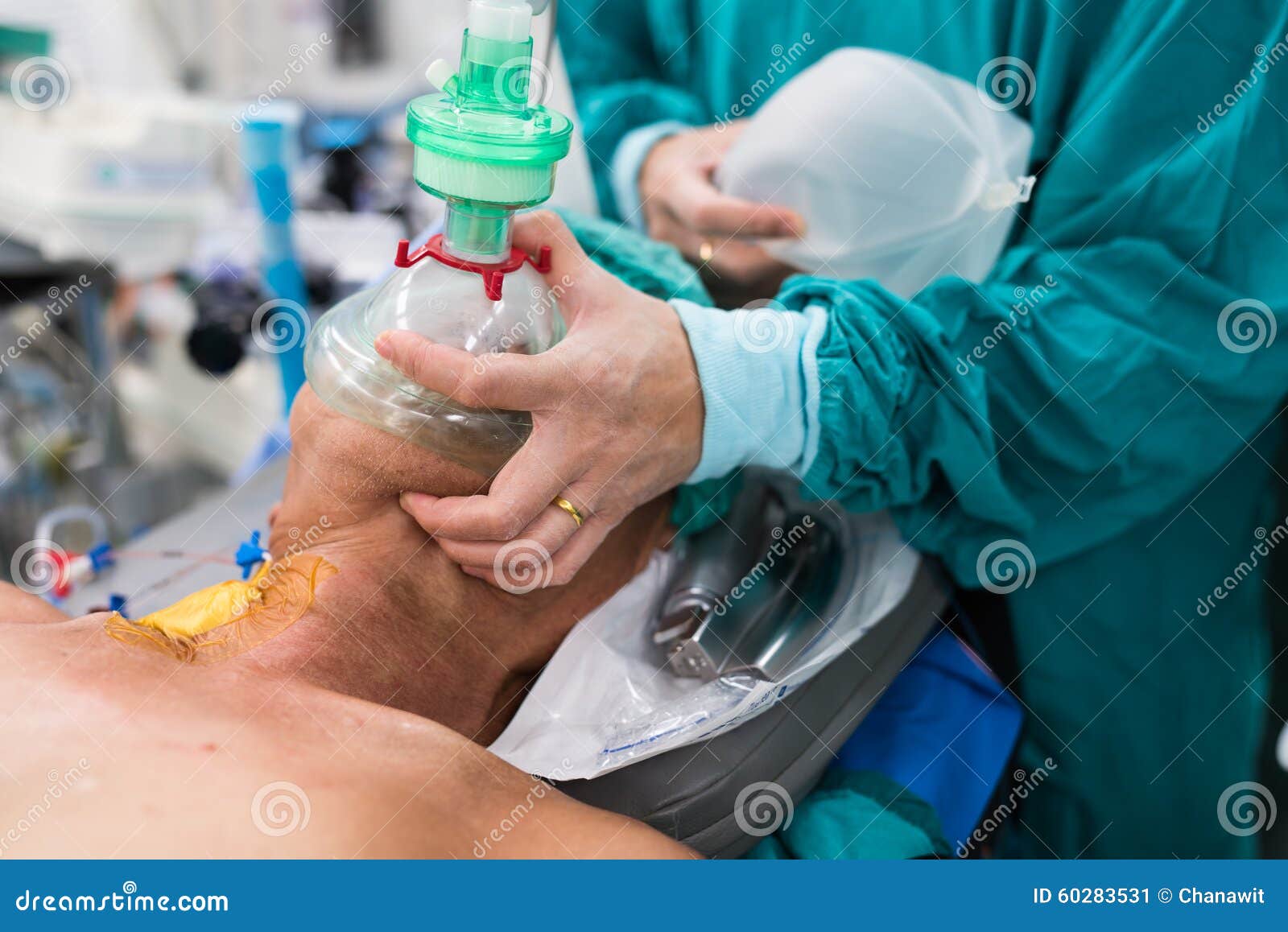 Pre Oxygenation for General Anesthesia Stock Image - Image of glove ...