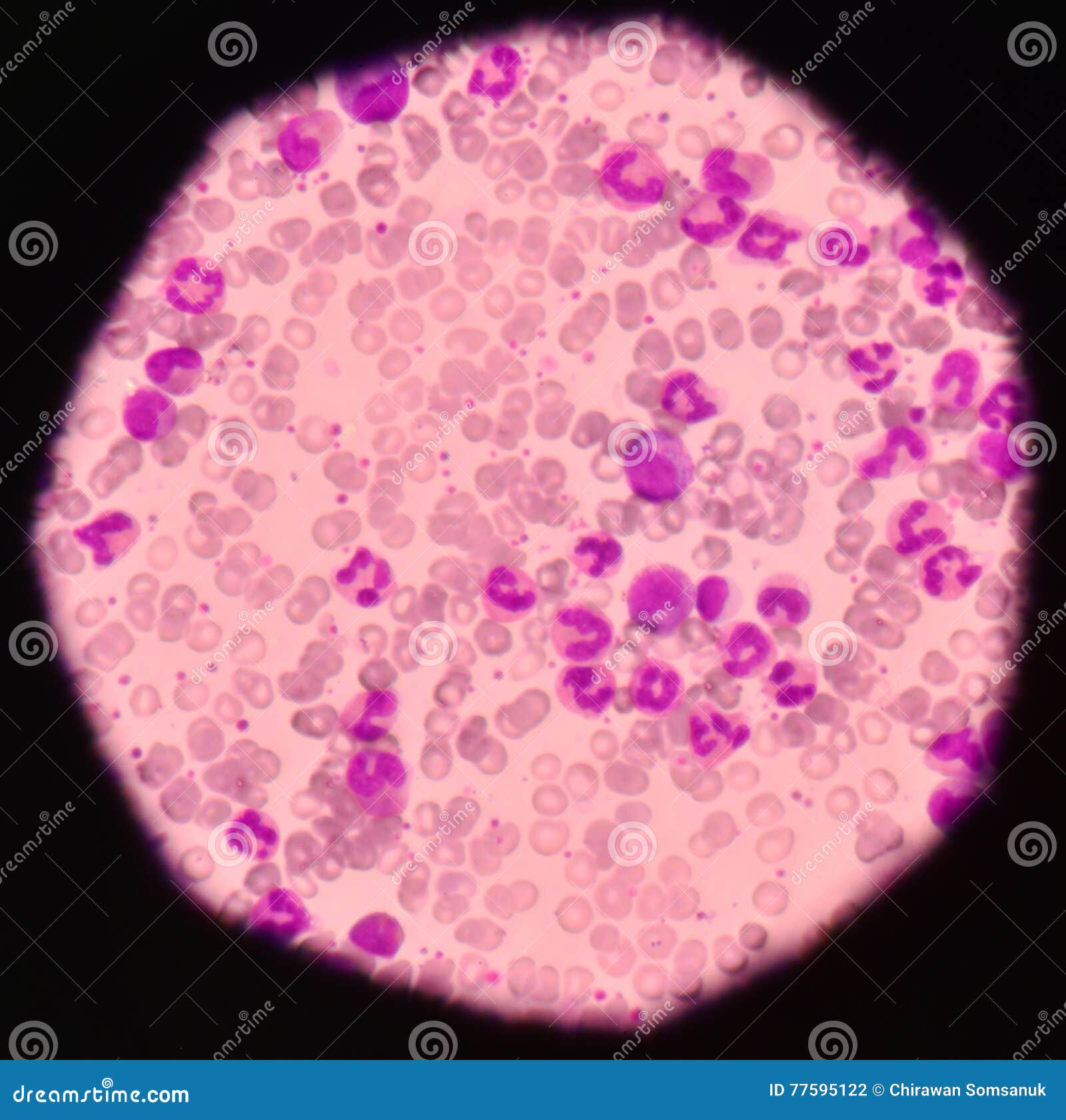A Precursor Cell, Also Called a Blast Cell or Simply Blast, is a Stock ...