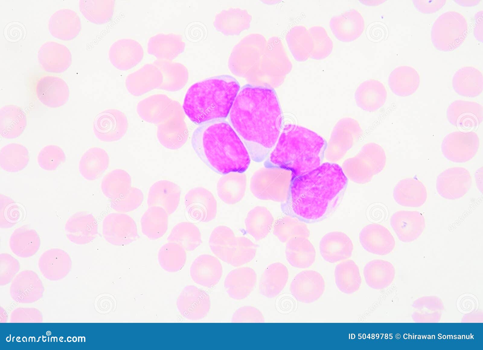 Precursor cell stock image. Image of analysis, blood - 50489785