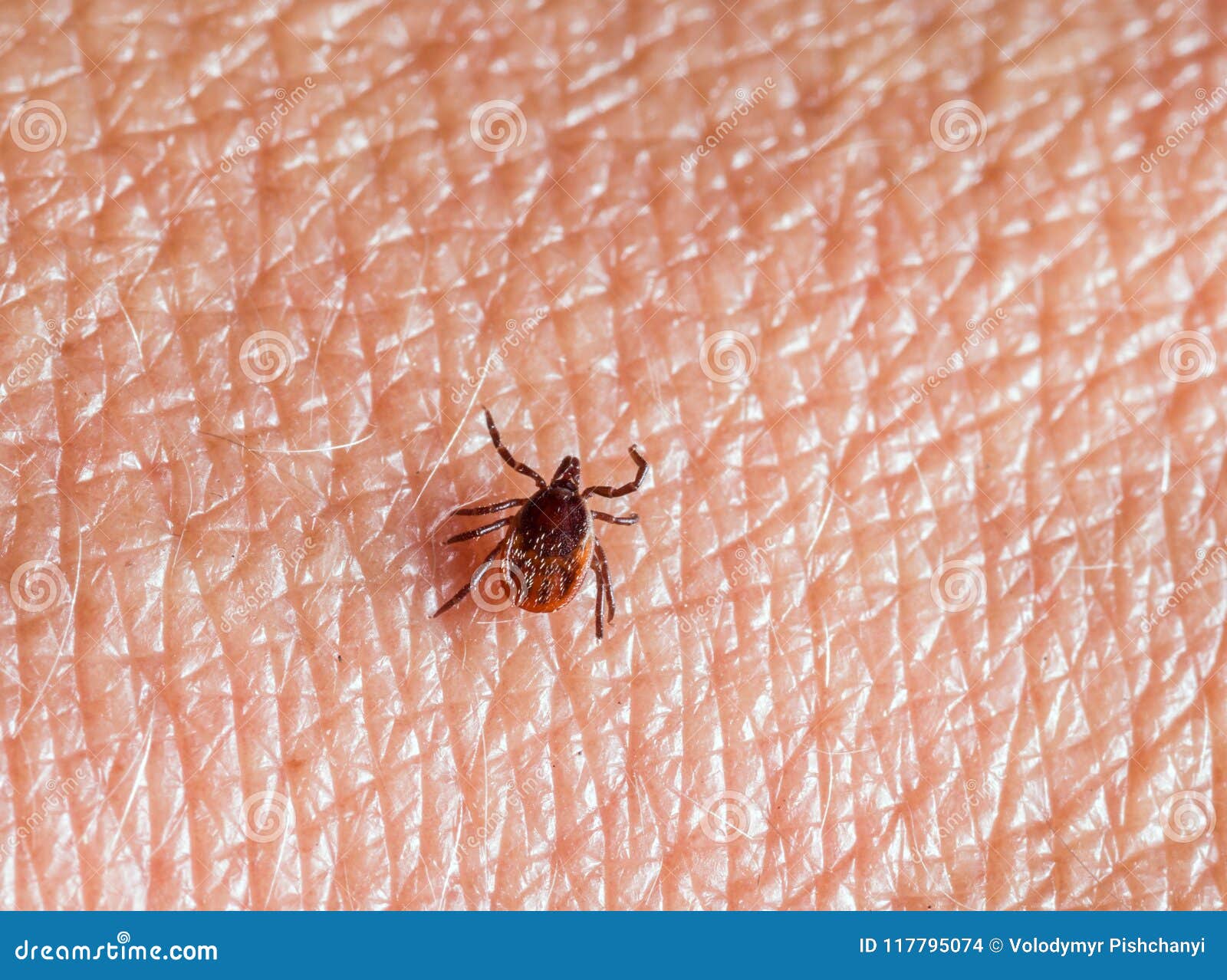 A Tick Crawls Palm Up On A Hand Close-up. Horizontal Orientation. Stock ...