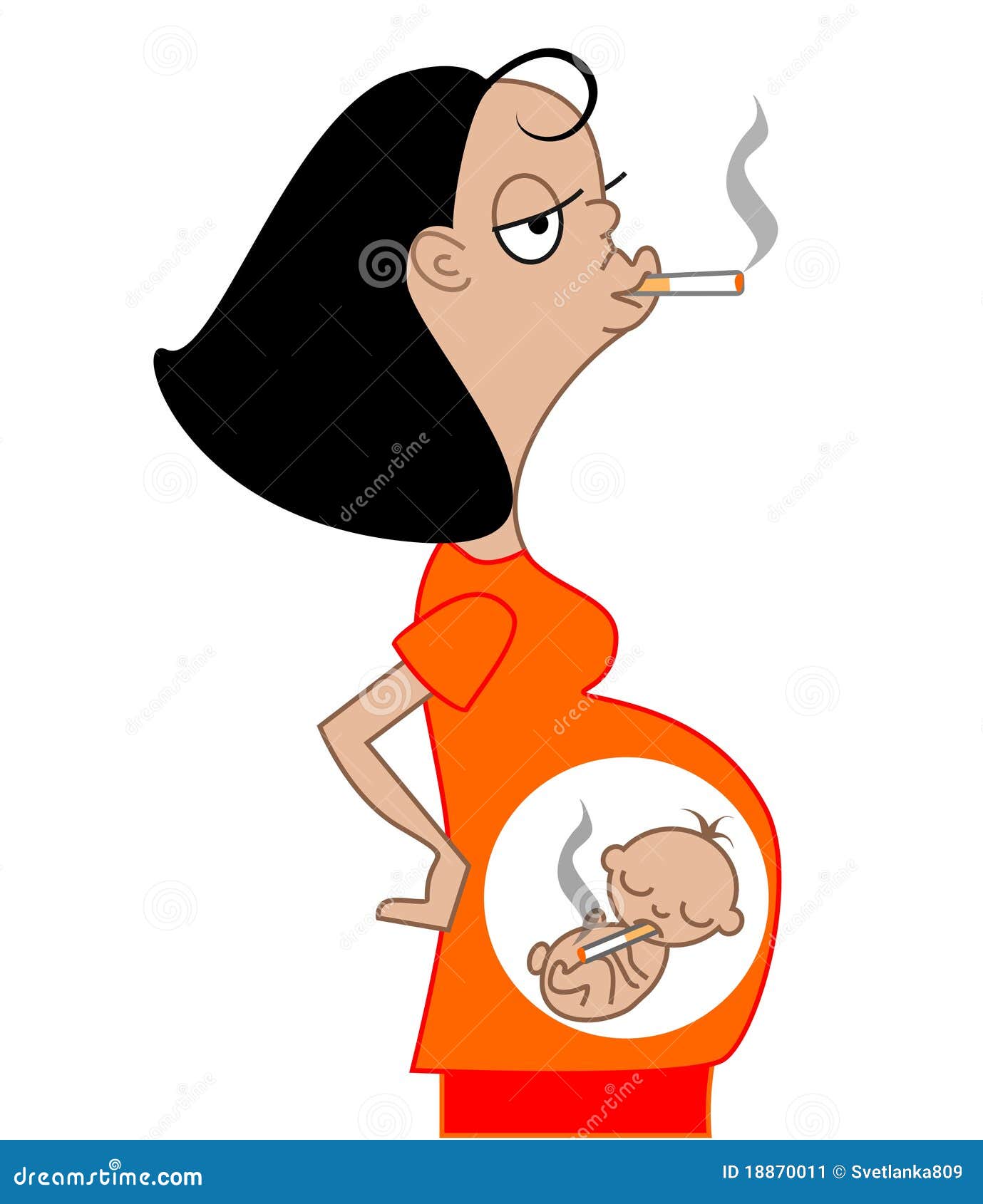 Pregnant woman stock vector. Illustration of unhealthy - 18870011