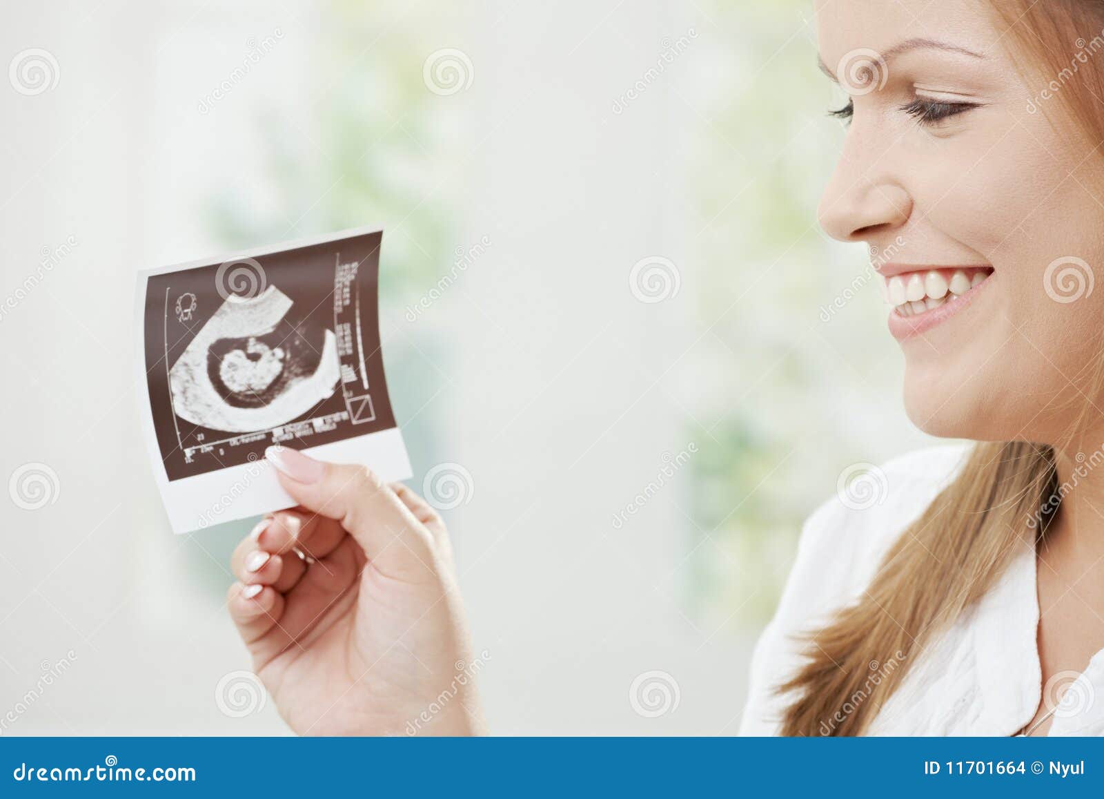 Pregnant Woman Holding Sonogram Stock Photo - Image of computer, face ...