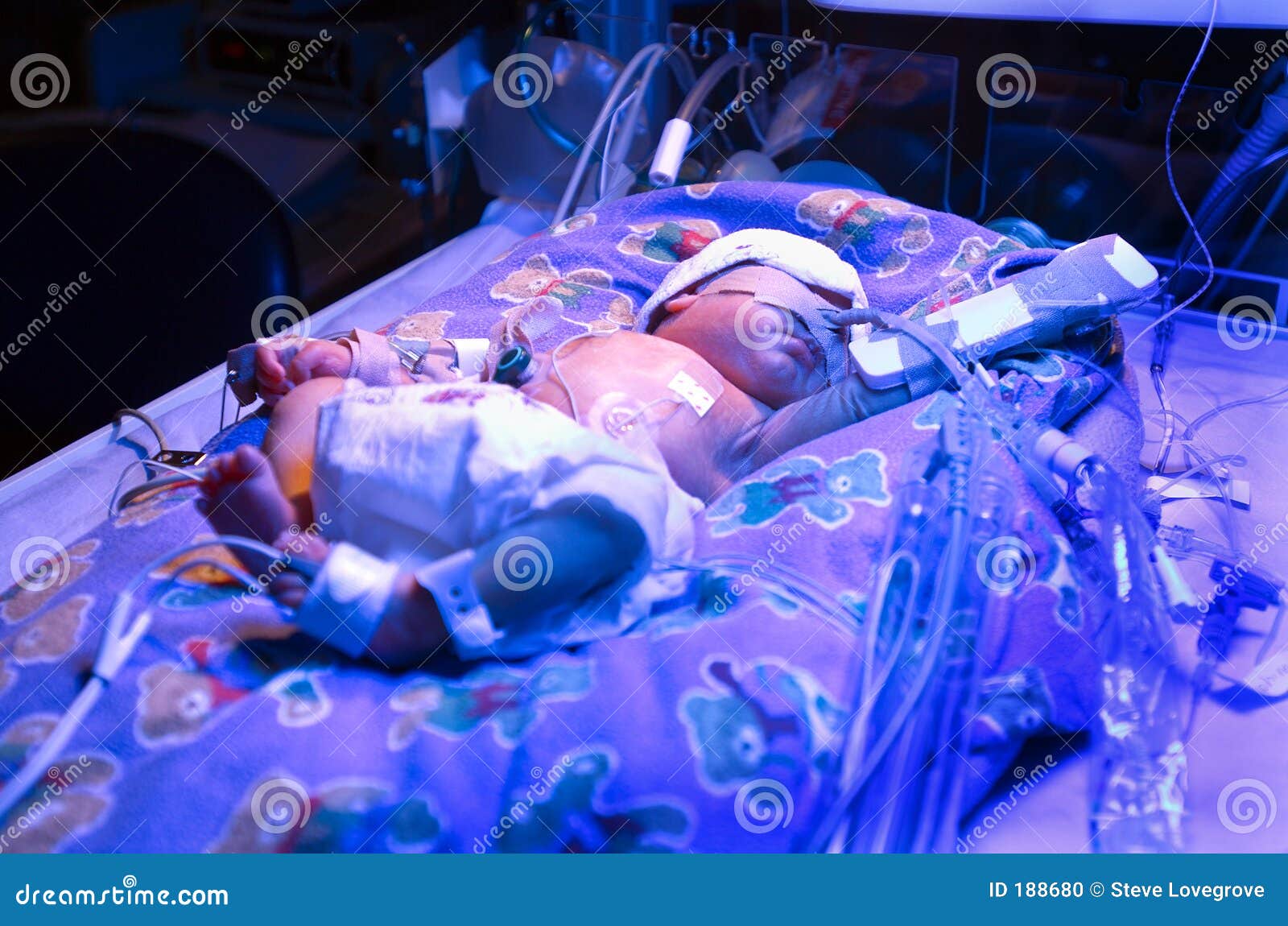 Premature Baby stock photo. Image of intensive, hospital - 188680