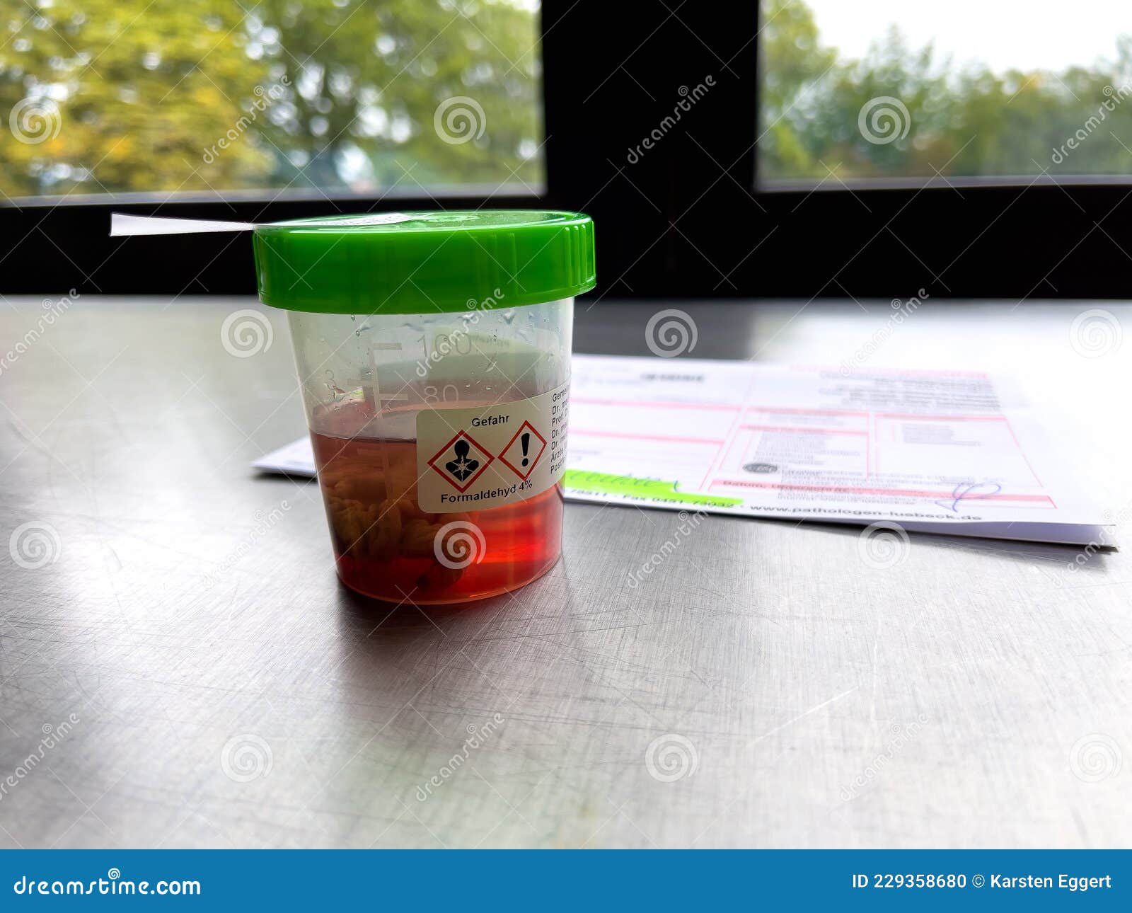 Preparation Pot Contains a Specimen for Histological Examination Stock ...