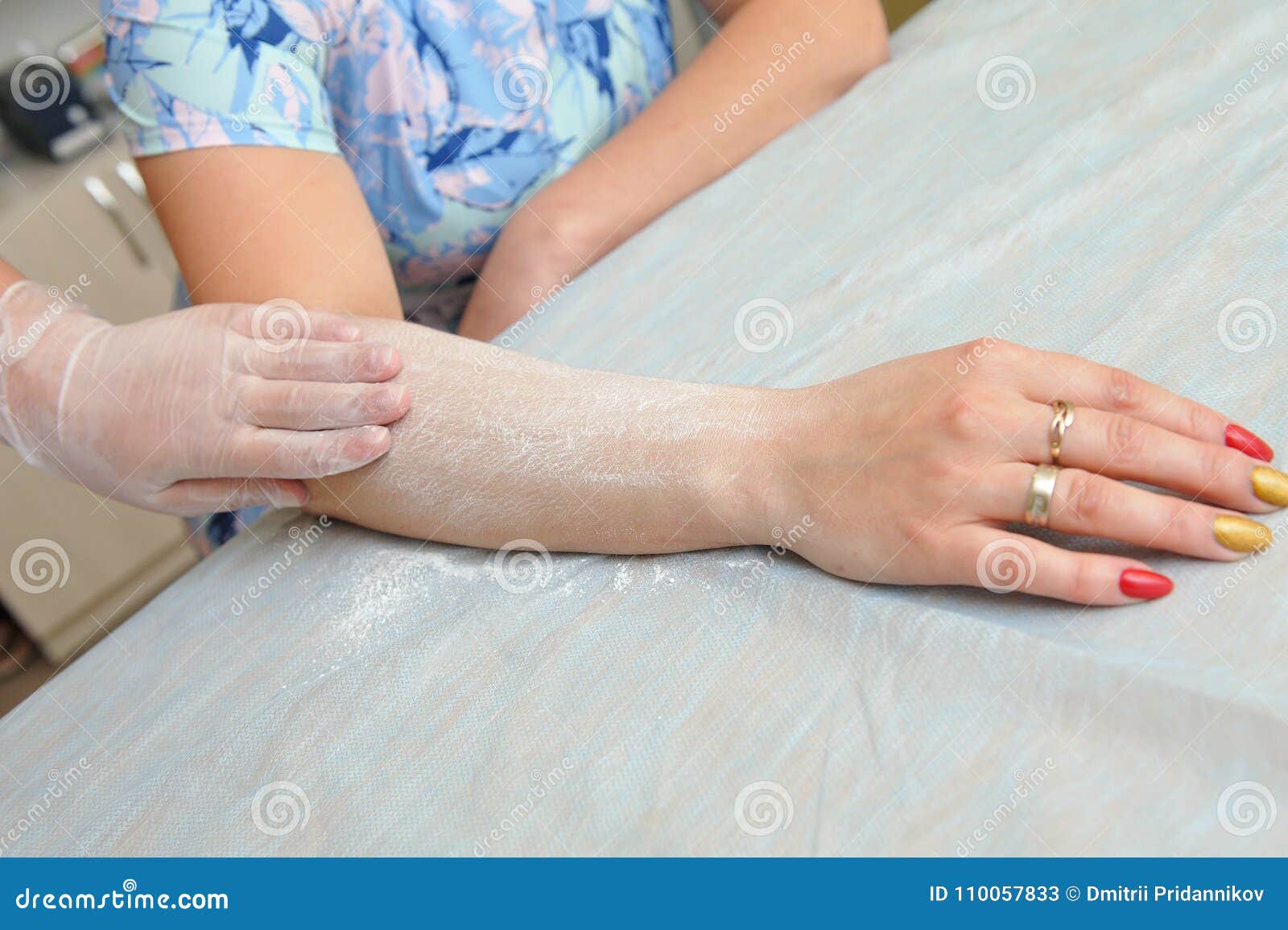 Preparation of Skin for Sugaring. the Skin is Treated with a Pow Stock ...