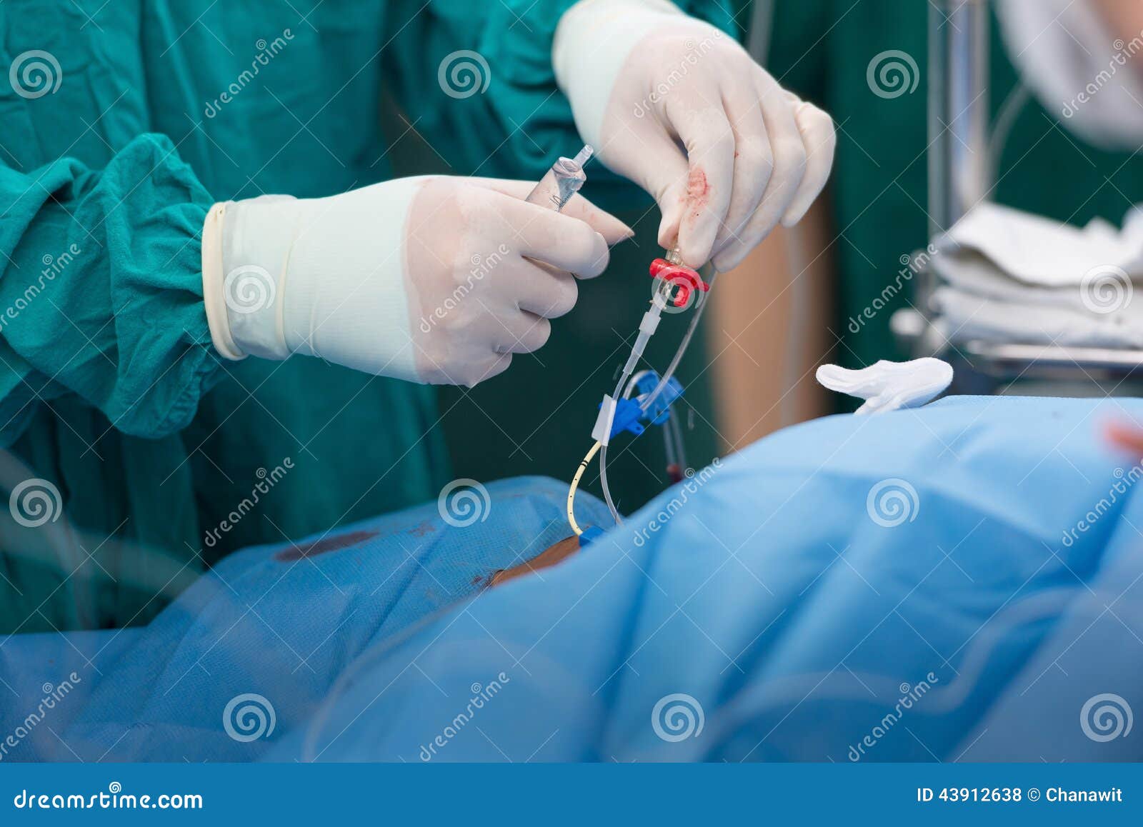 Central Venous Port Insertion Stock Photography | CartoonDealer.com ...