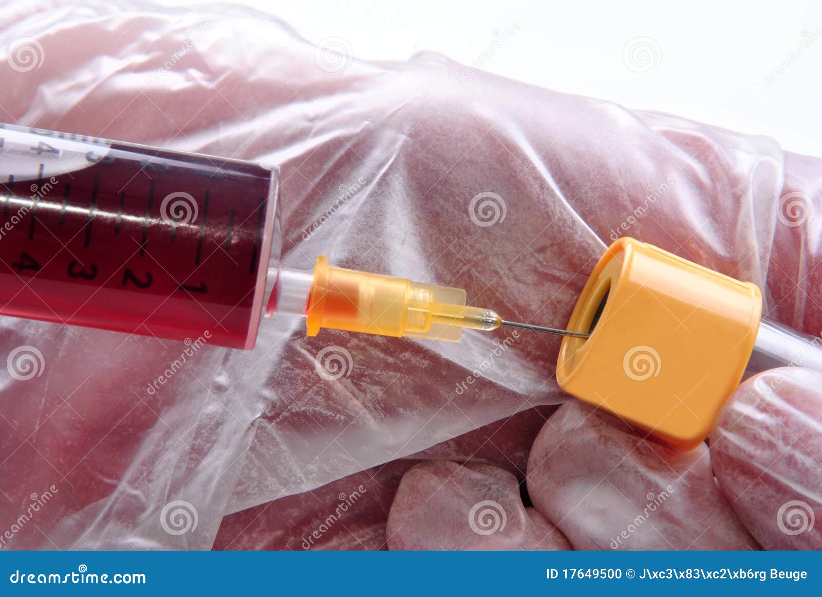 Prepare Human Blood for a Test Stock Photo - Image of test, staff: 17649500