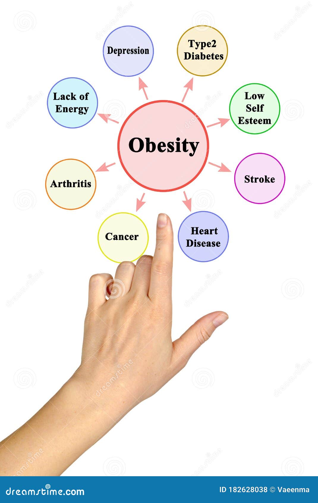 Eight Consequences of Obesity Stock Photo - Image of obesity, cancer ...