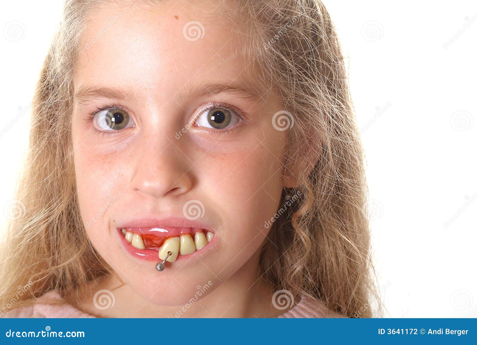 Pretty Little Girl with Ugly Teeth (copy Space Rig Stock Photo - Image ...