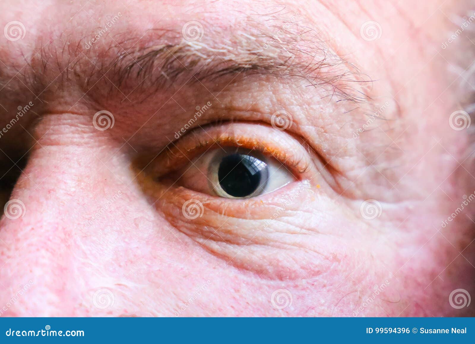 Primer De Un Globo Del Ojo Dilatado Foto de archivo - Imagen de salud ...