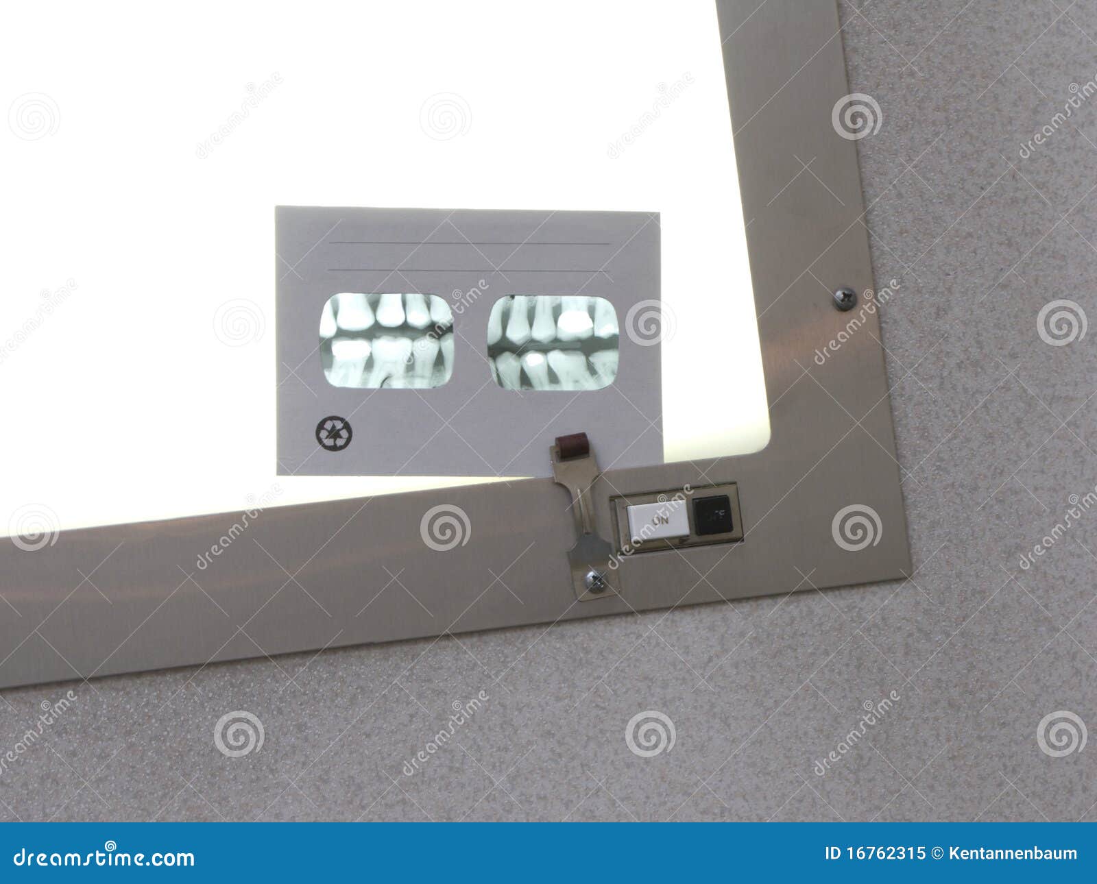 Primo Piano Dentale Dei Raggi X Immagine Stock - Immagine di esame ...