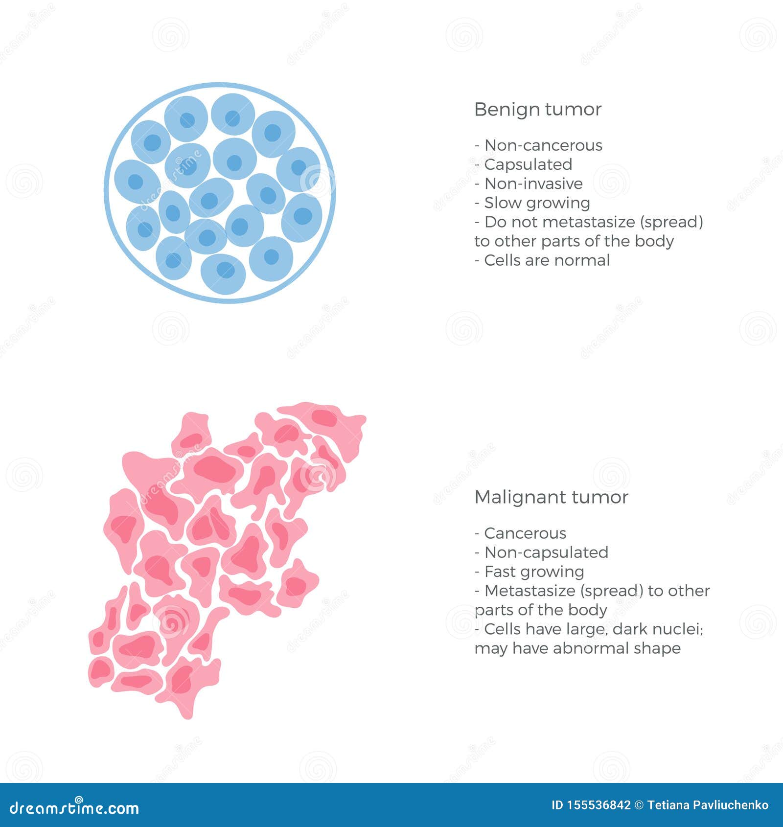 Benign Tumor Can Separate A Person From The World And Lock In An ...